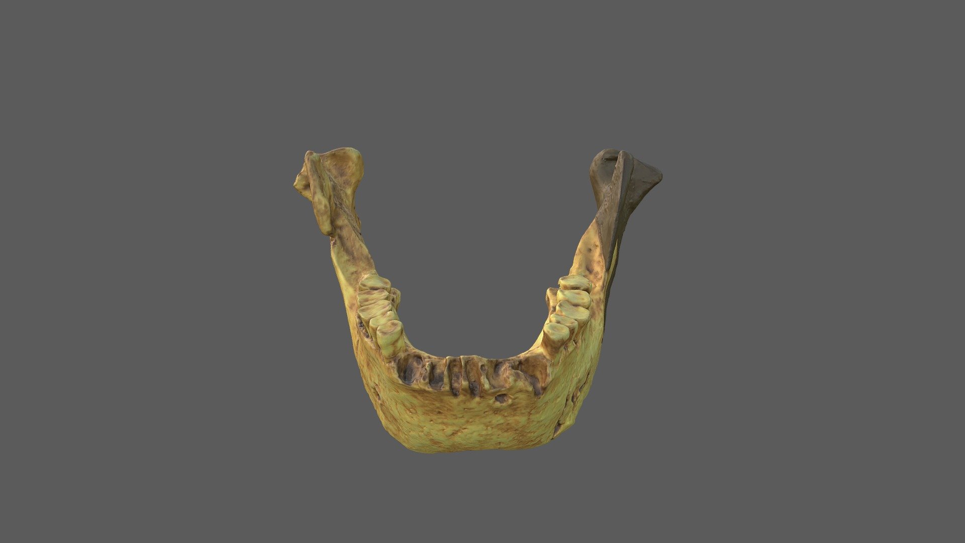 Atapuerca 5 Jaw with Texture - 3D model by Wellesley College ...