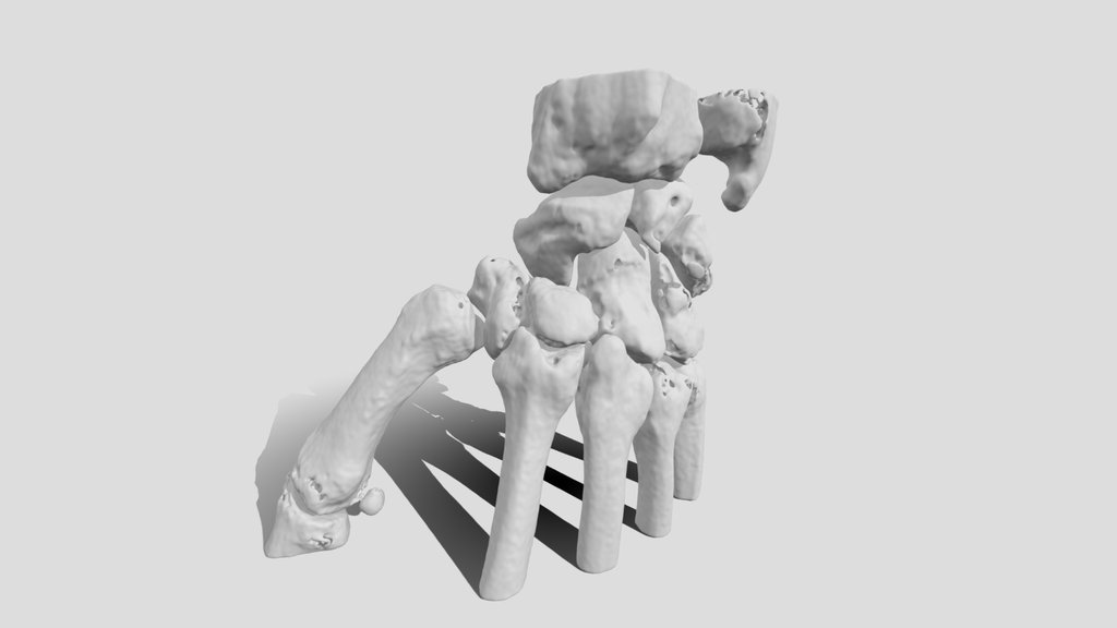 Skeletal Trauma - A 3D model collection by Terrie Simmons-Ehrhardt ...