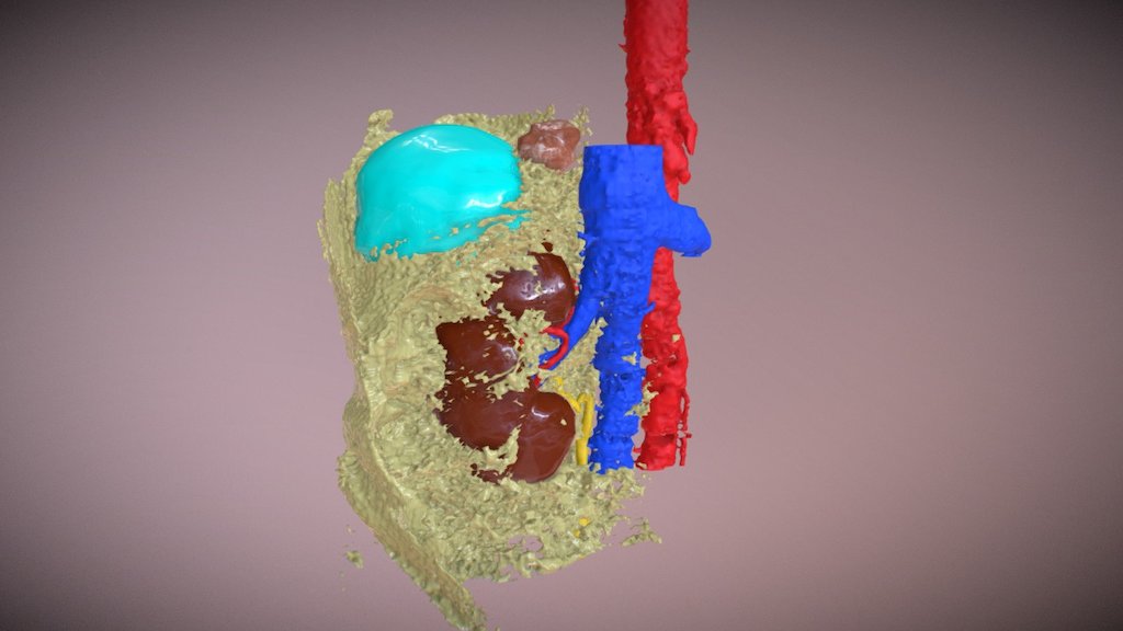 NA_Kidney_fat_tissue - 3D model by URO (@SIULIVE) [32fa885] - Sketchfab
