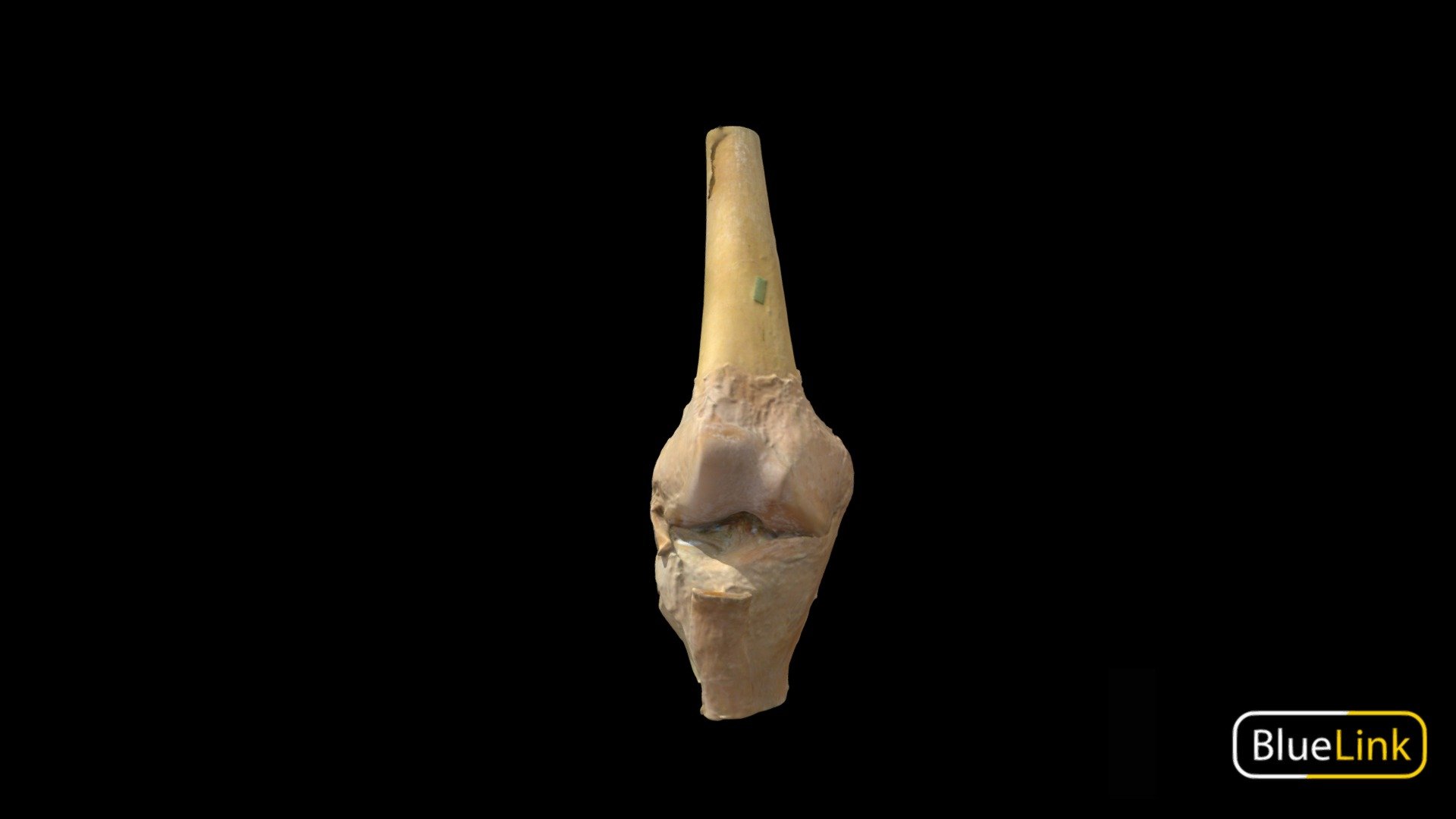 Knee Joint - Right, Labeled - 3D model by Bluelink Anatomy ...