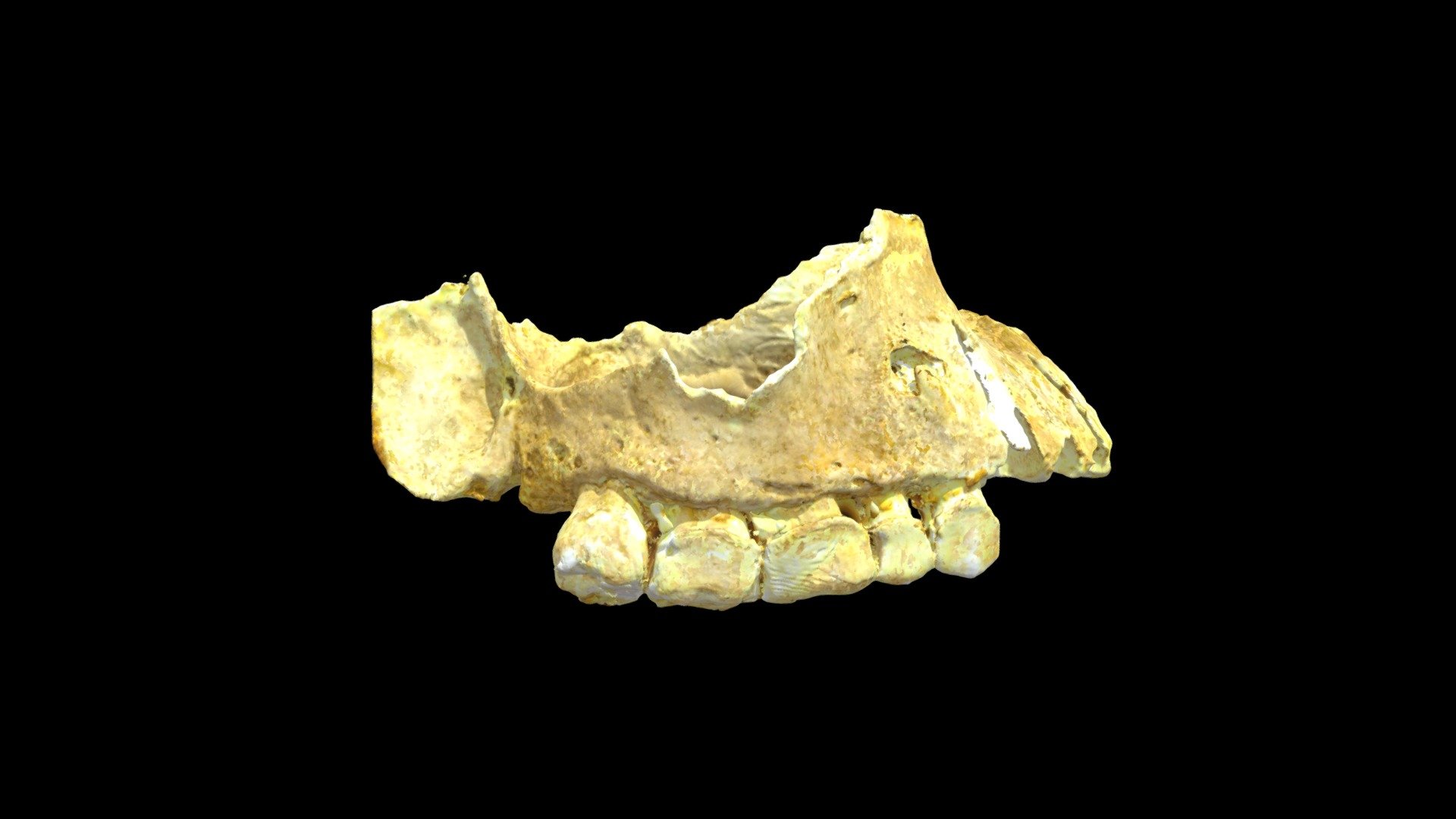 R maxilla with calculus on teeth (VCU_3D_4018) - 3D model by Virtual ...