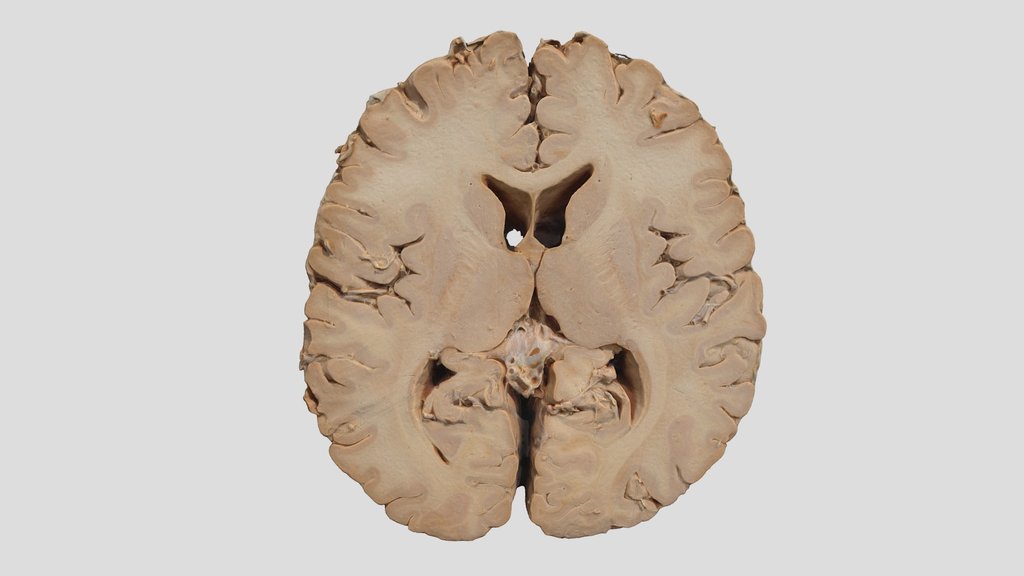 Neuroanatomy 3D - A 3D model collection by anatomydecoded - Sketchfab