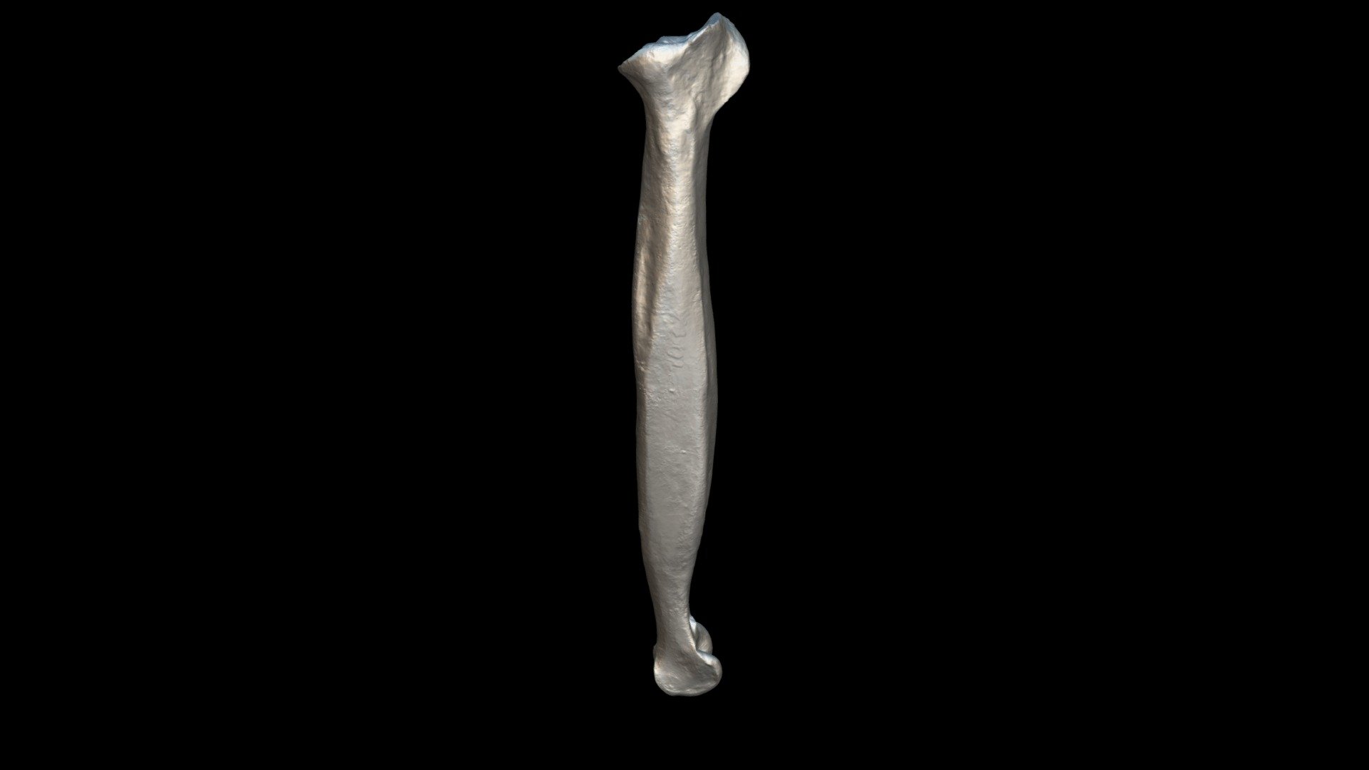 Chicken bone with osteopetrosis (shape) - Download Free 3D model by ...