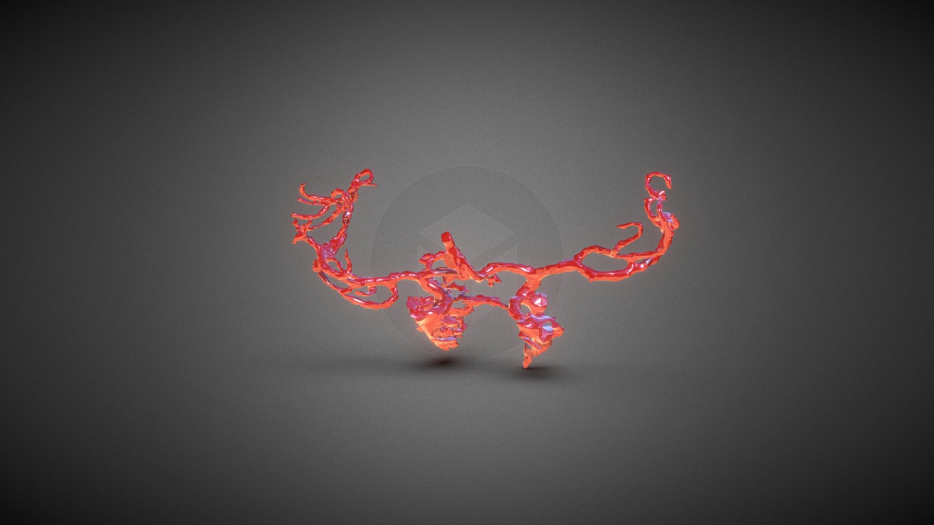 Left Pcom Aneurysm 3d Model By Dr Samuel Damin Sdamin [34e6de1