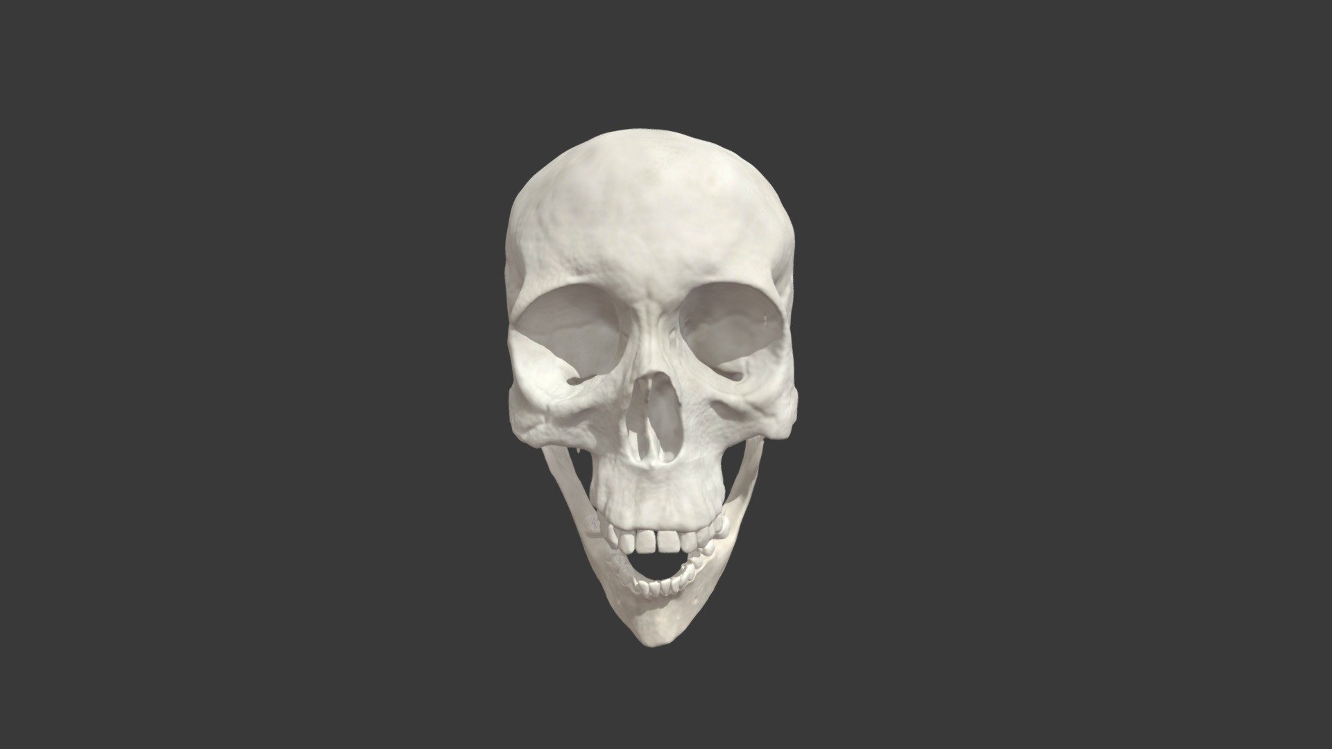 Down Syndrome Skull - 3D model by University of Dundee, CAHID (@anatomy ...