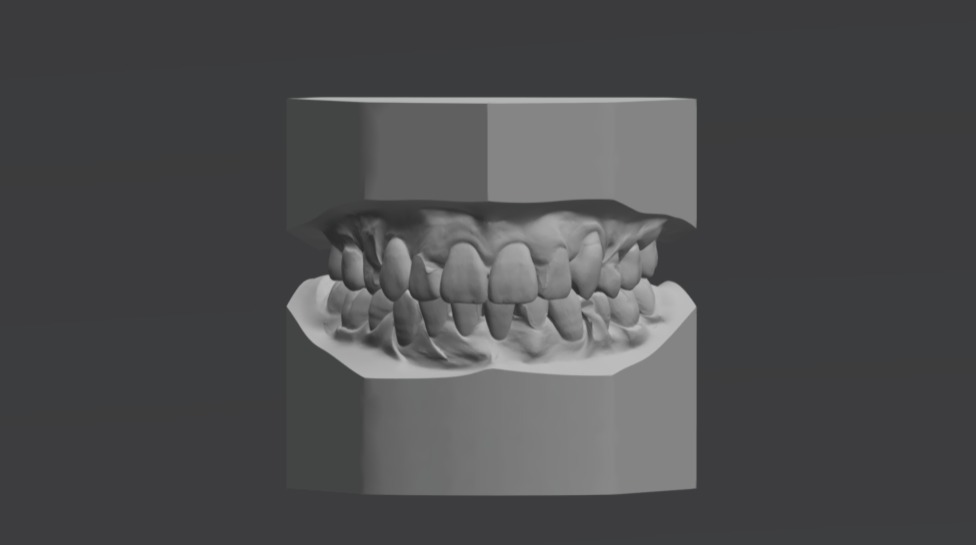 Sculpting Reference - Anatomy/Expression - A 3D model collection by ...