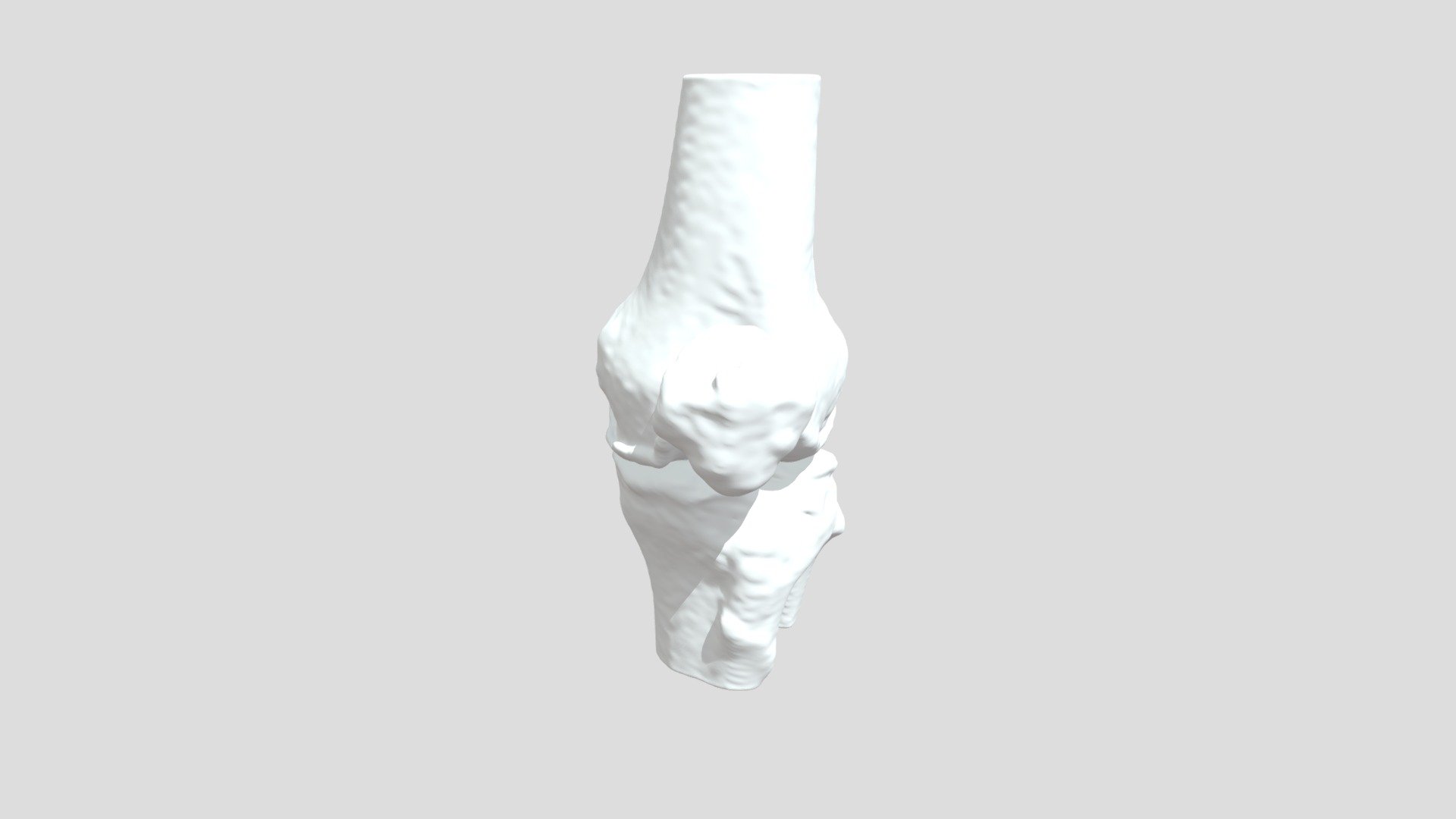 Segmentation Kann She Lt Bone - 3D model by curisdata.science [35cb27a ...