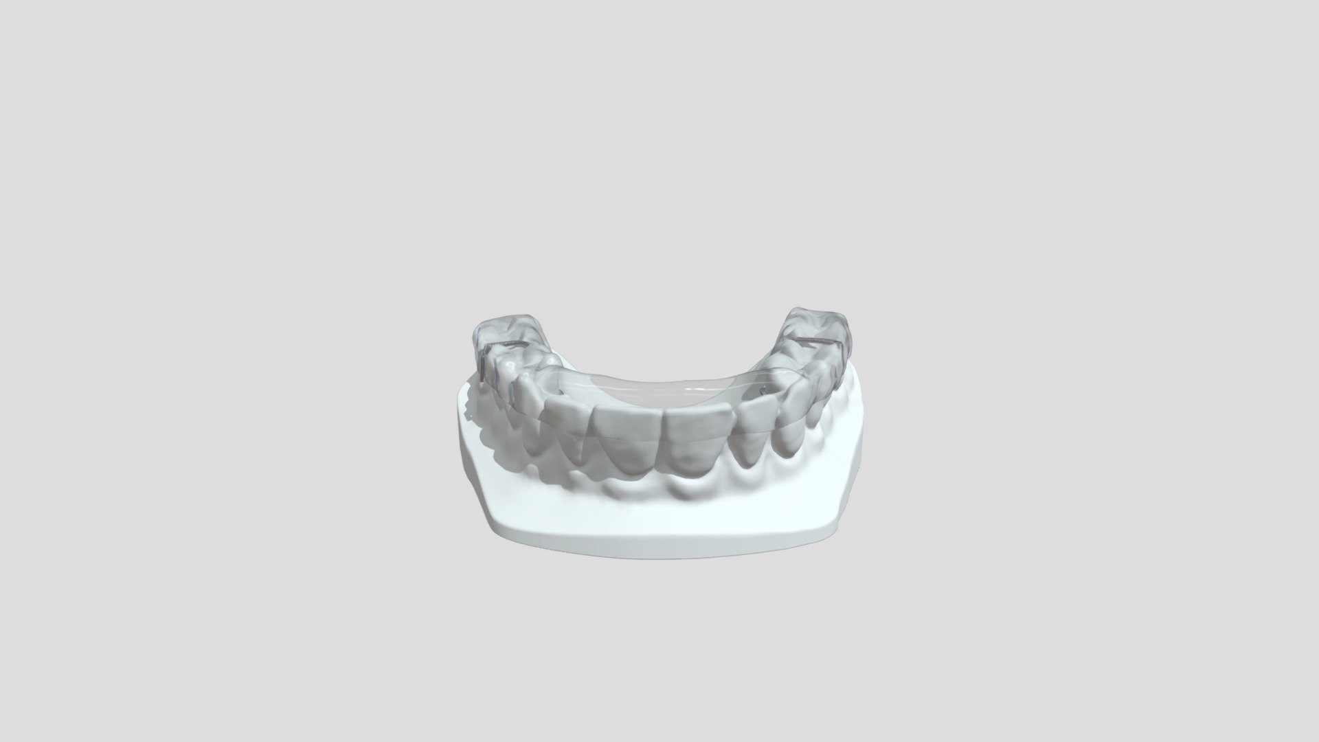 Dawson Splint - 3D model by ODL OrthoLab (@Odlortho) [35d455b] - Sketchfab