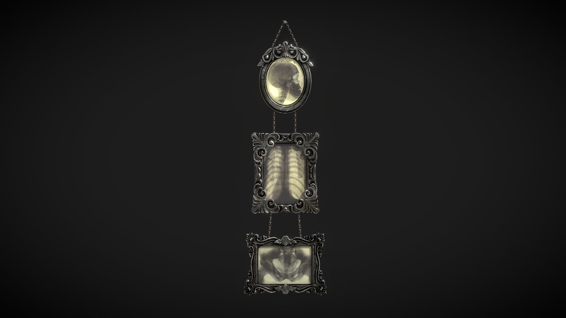 Skeleton Xray Frames / Painting Wall Decoration - Buy Royalty Free 3D ...