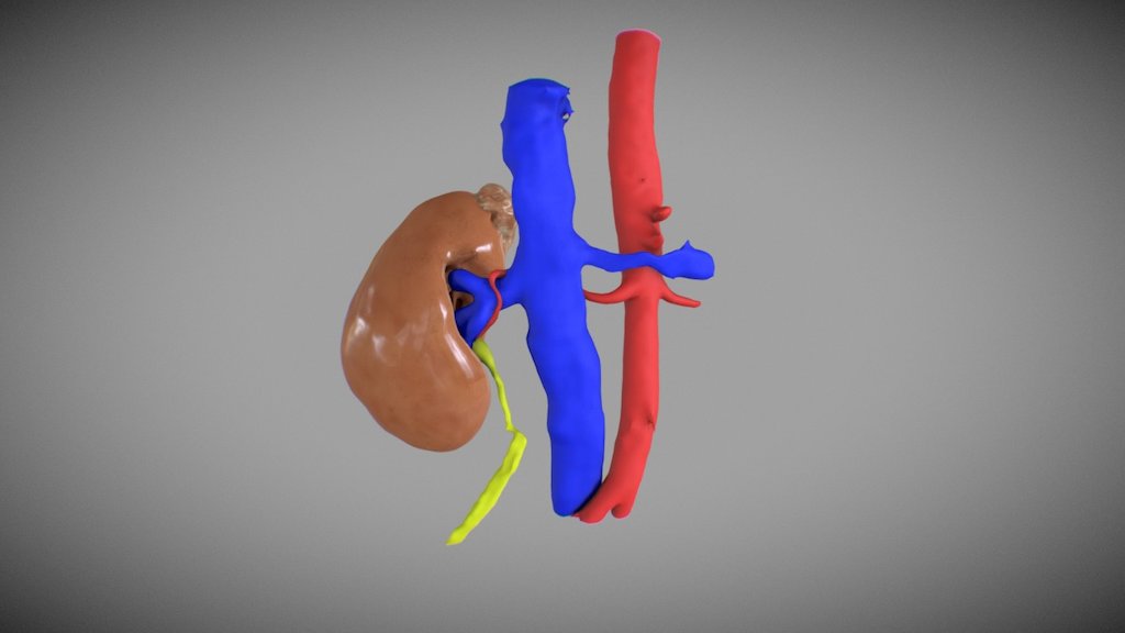 02_Kidney_CT - 3D model by URO (@SIULIVE) [35ddb69] - Sketchfab
