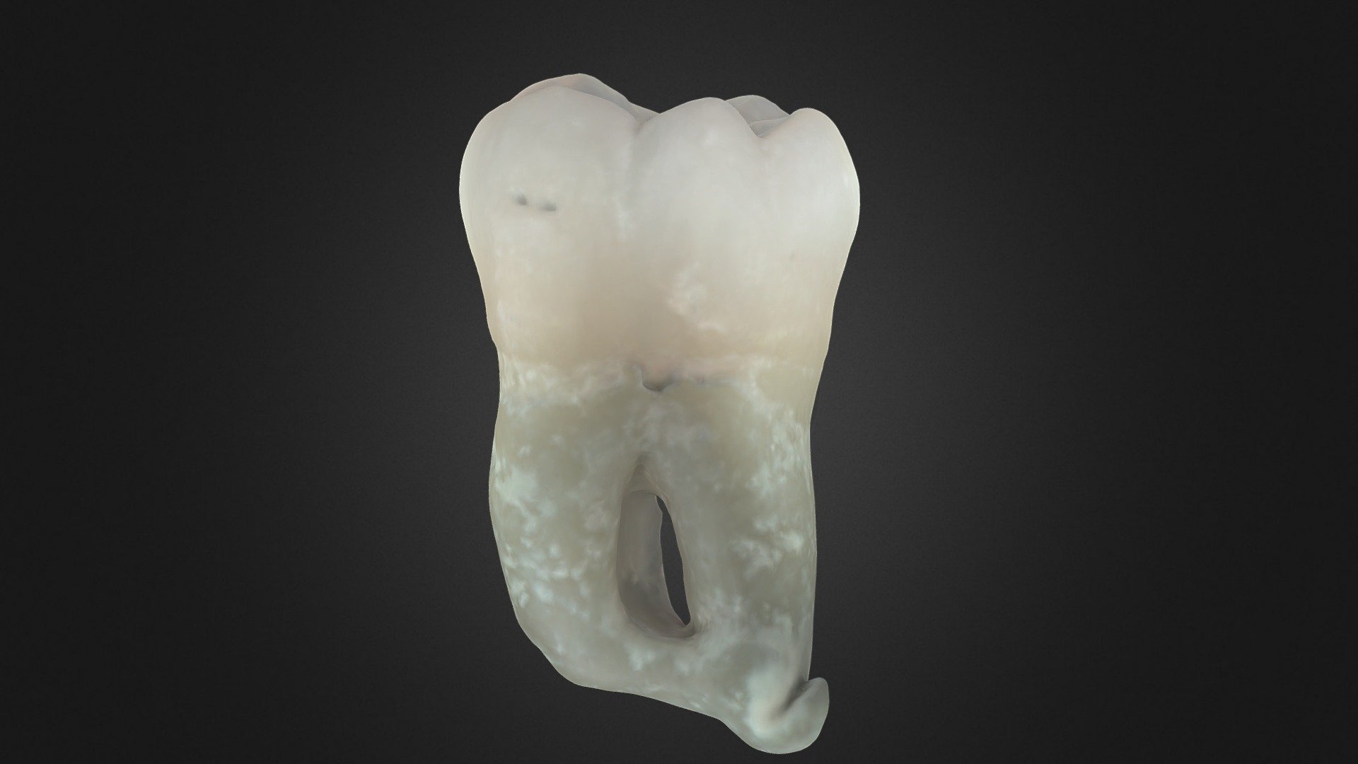 Dente 38 - Lower Left Third Molar (ID 38a) - Download Free 3D model by ...