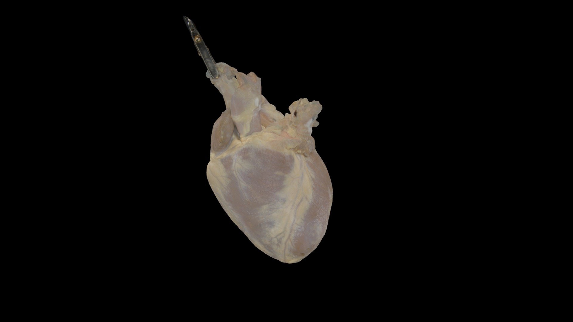 Pediatric Human Heart Donation - Download Free 3D model by ...