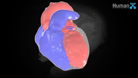 Pacemaker 3D models - Sketchfab