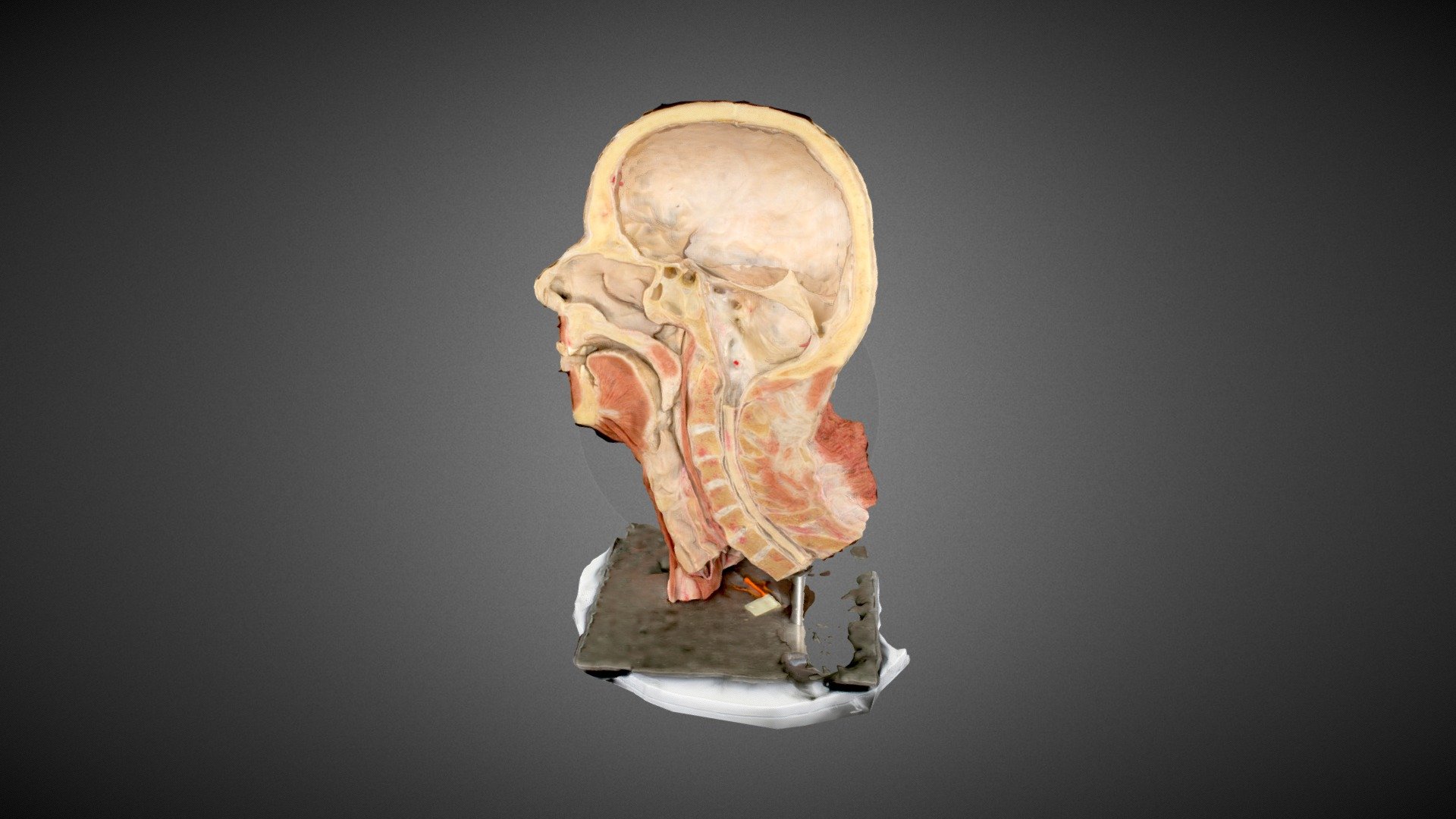 plastination hi res - 3D model by ScienceLifeNY [36a9cc8] - Sketchfab