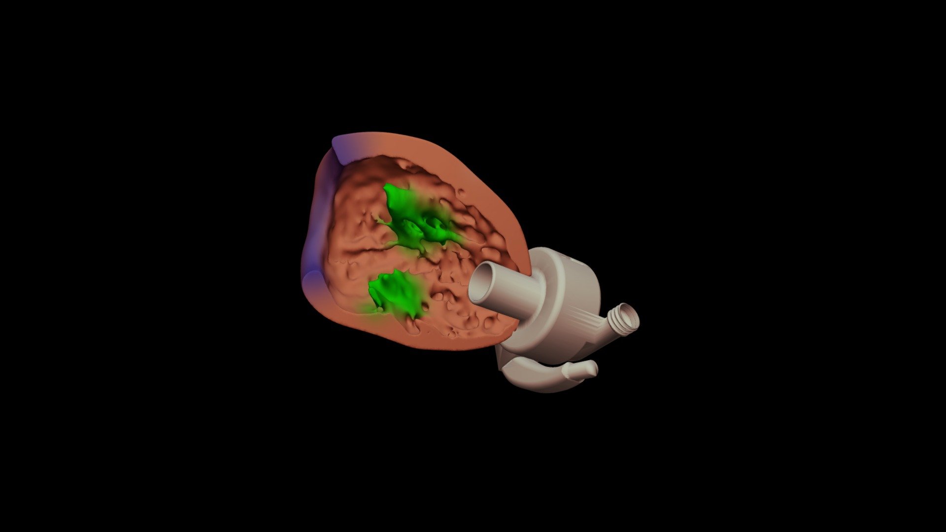 HU-CVC:20:007 (free wall view) - 3D model by Imre J. Barabás, MD, M.Sc ...