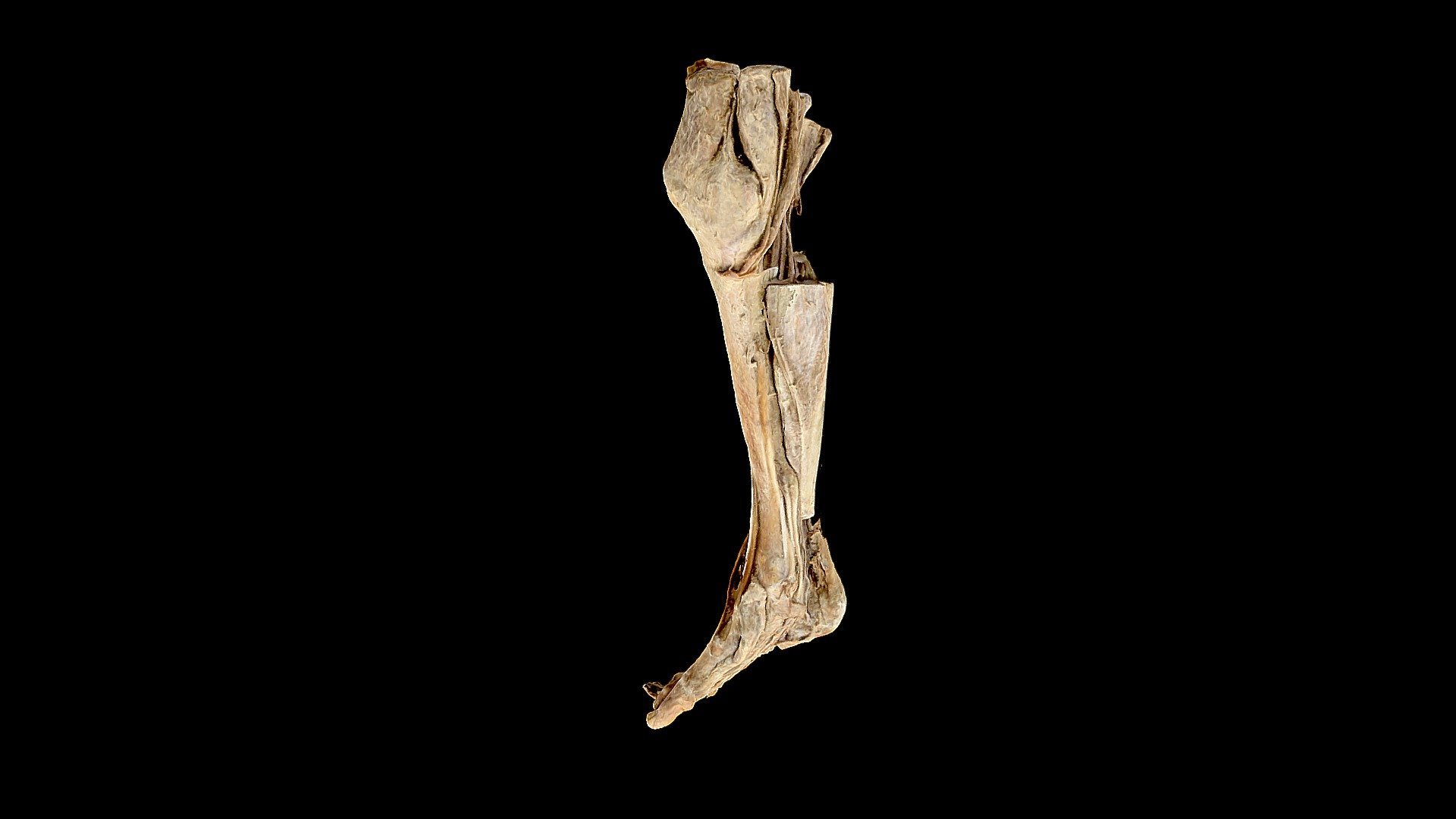 Lower Leg - 3D model by IslandMedicalProgramAnatomy ...