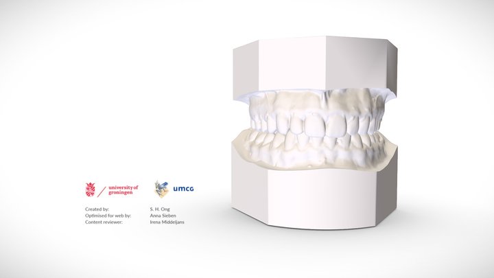 Upper-jaw 3D models - Sketchfab
