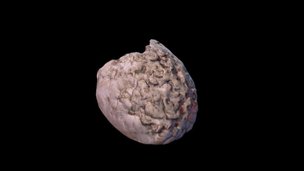 Syphilis - 3D model by ramost1 [3771807] - Sketchfab