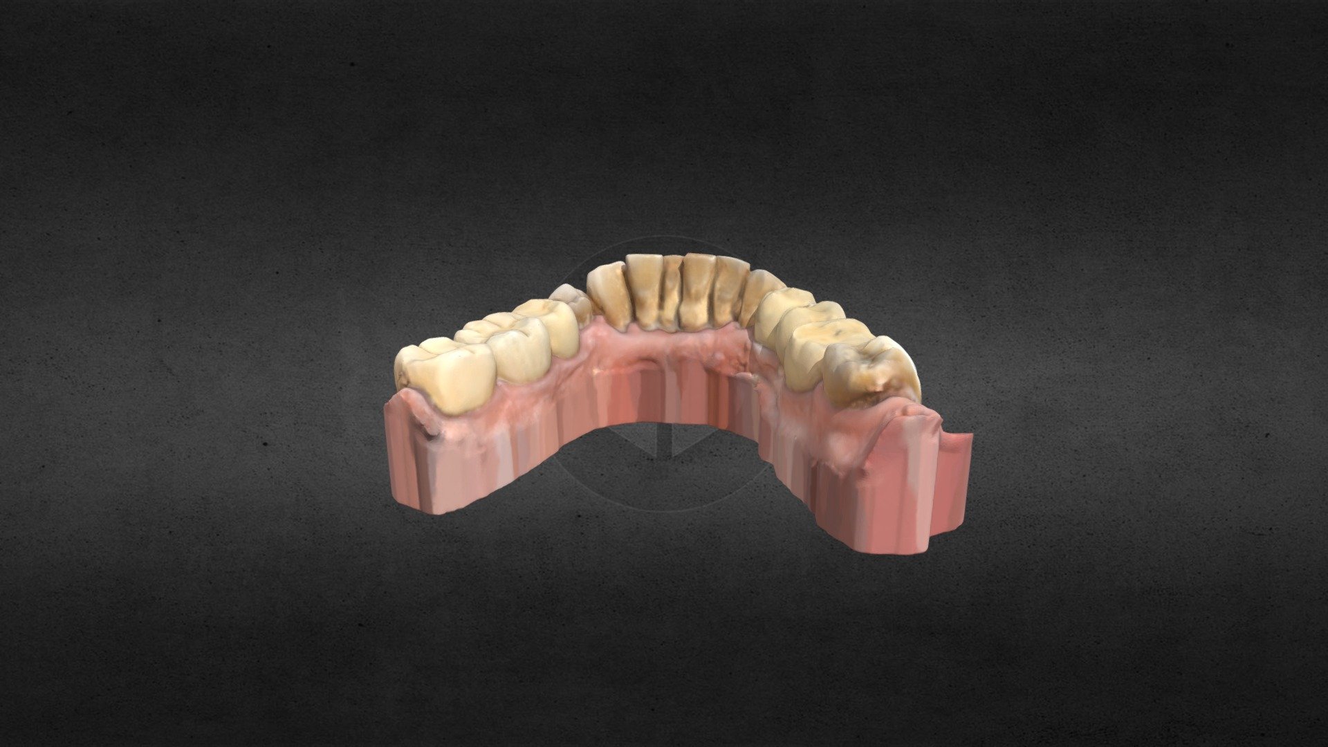 Что мы лечим - 3D model by Dental Art Gallery (@mihail.moonz) [378eb49 ...