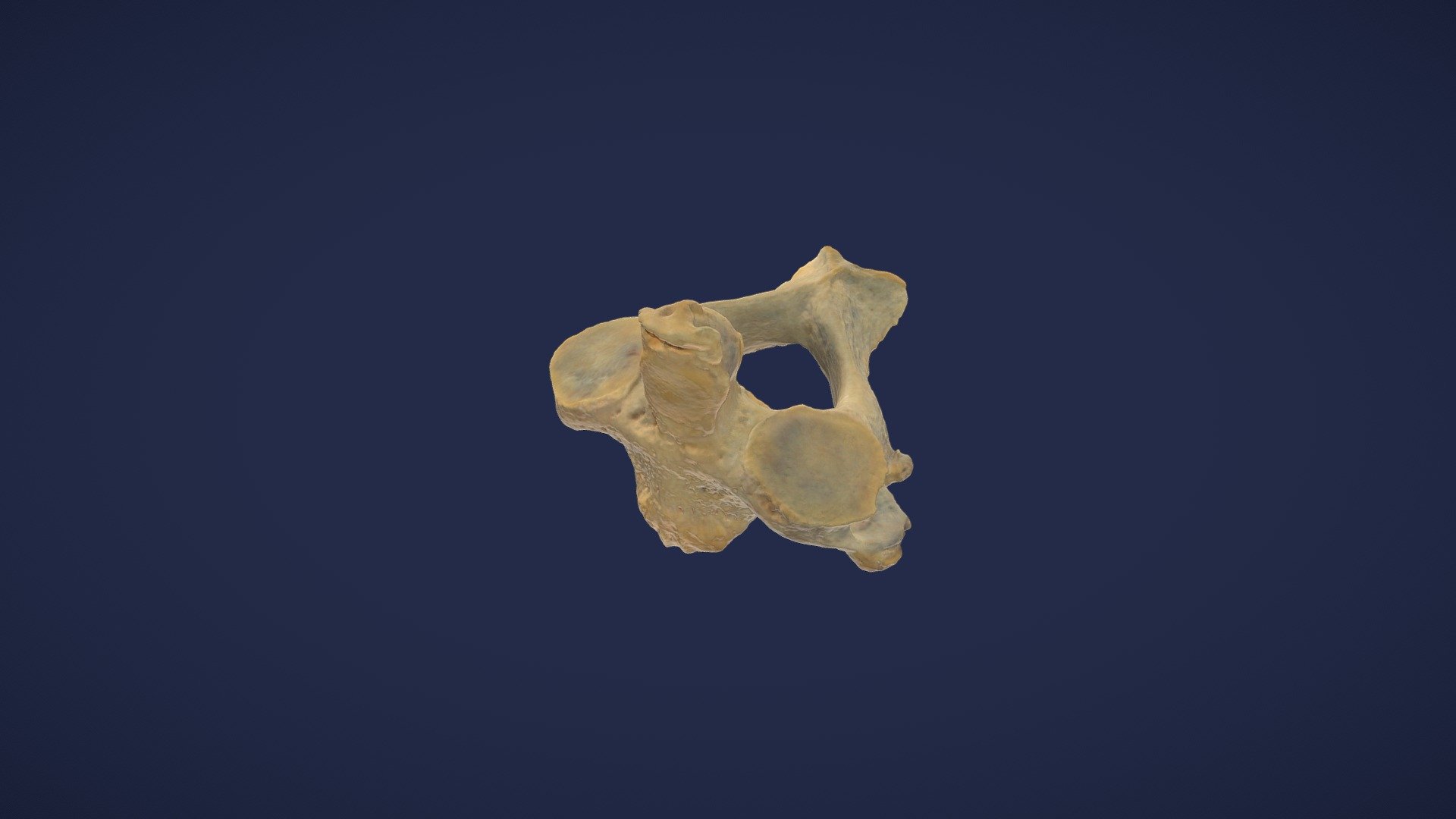 Axis - 3D model by Institute of Anatomy Rostock (@Alexander.Hawlitschka ...