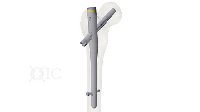 OIC - Sketchfab