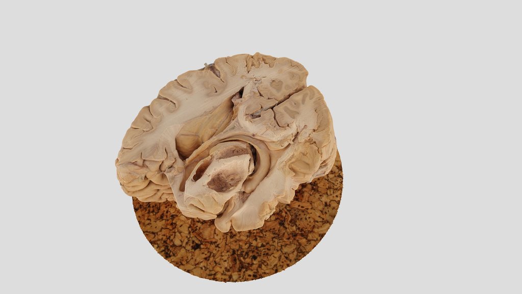 Neuroanatomy - A 3D model collection by kucharm - Sketchfab
