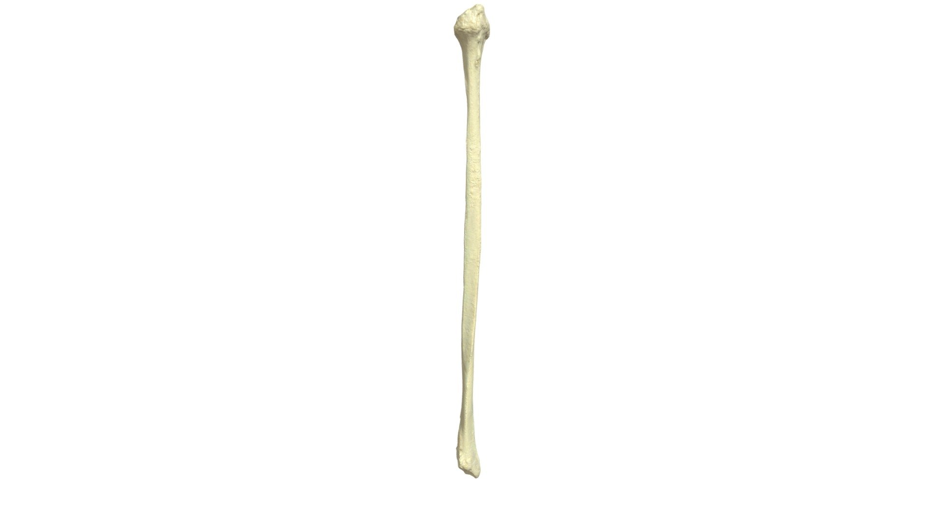 Fibula R - Proximale epifyse - annotaties - 3D model by Universiteit ...