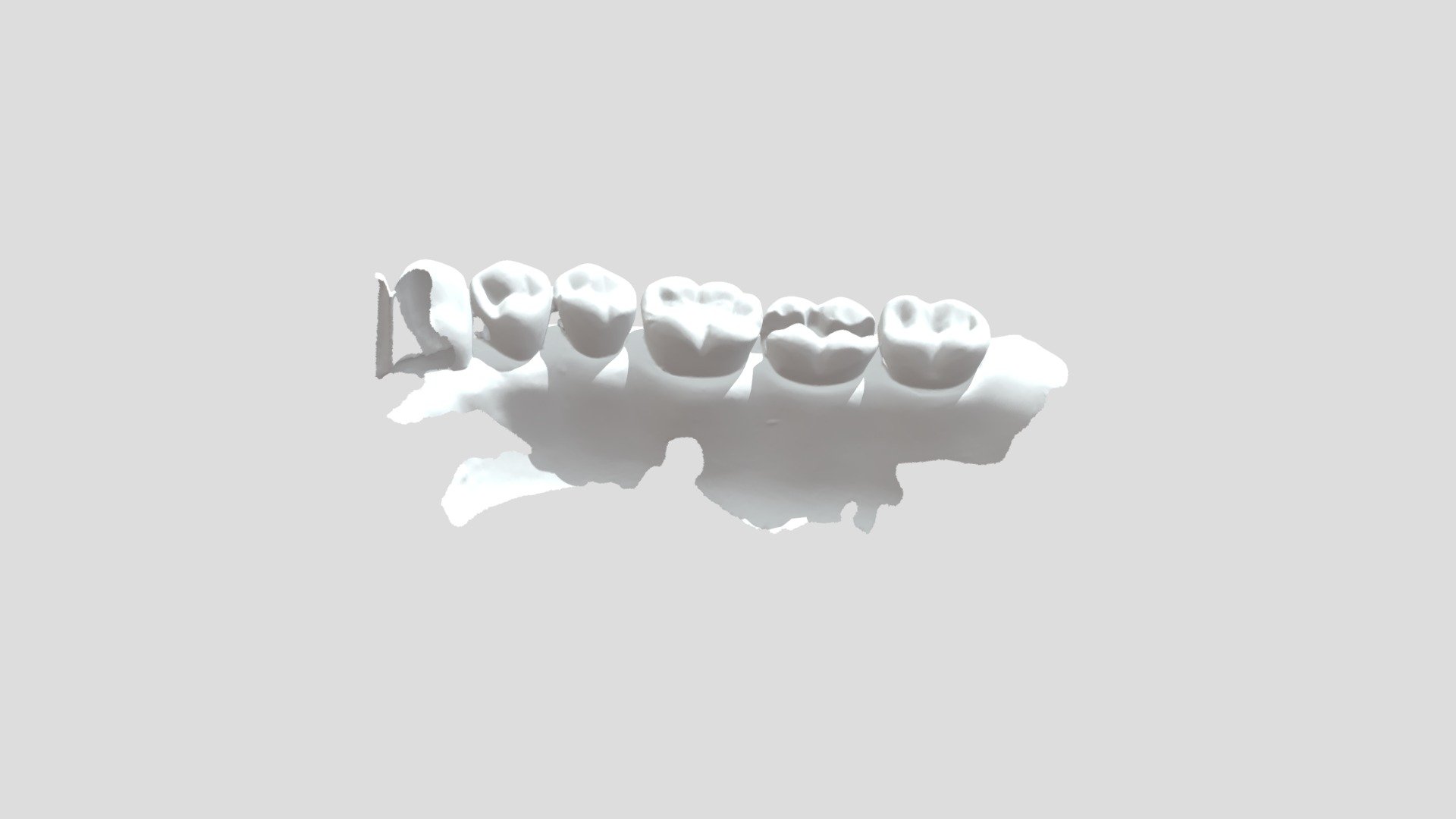 09082023-ODN 324 RCP MOD 47-maxilar - 3D model by catalinamelo [392ae84 ...