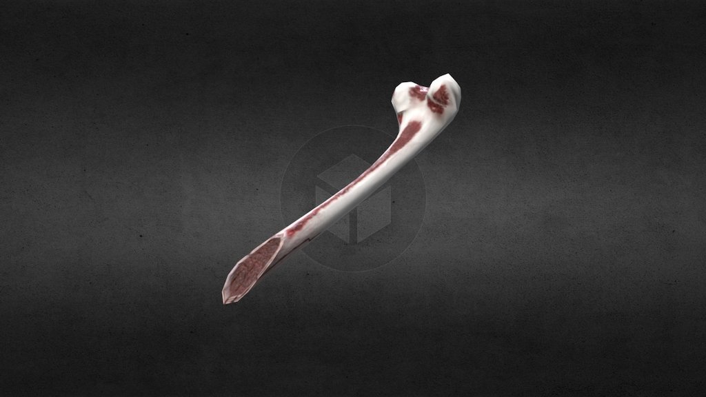 Broken bone (Femur) - 3D model by Dirk Jan ter Brugge ...