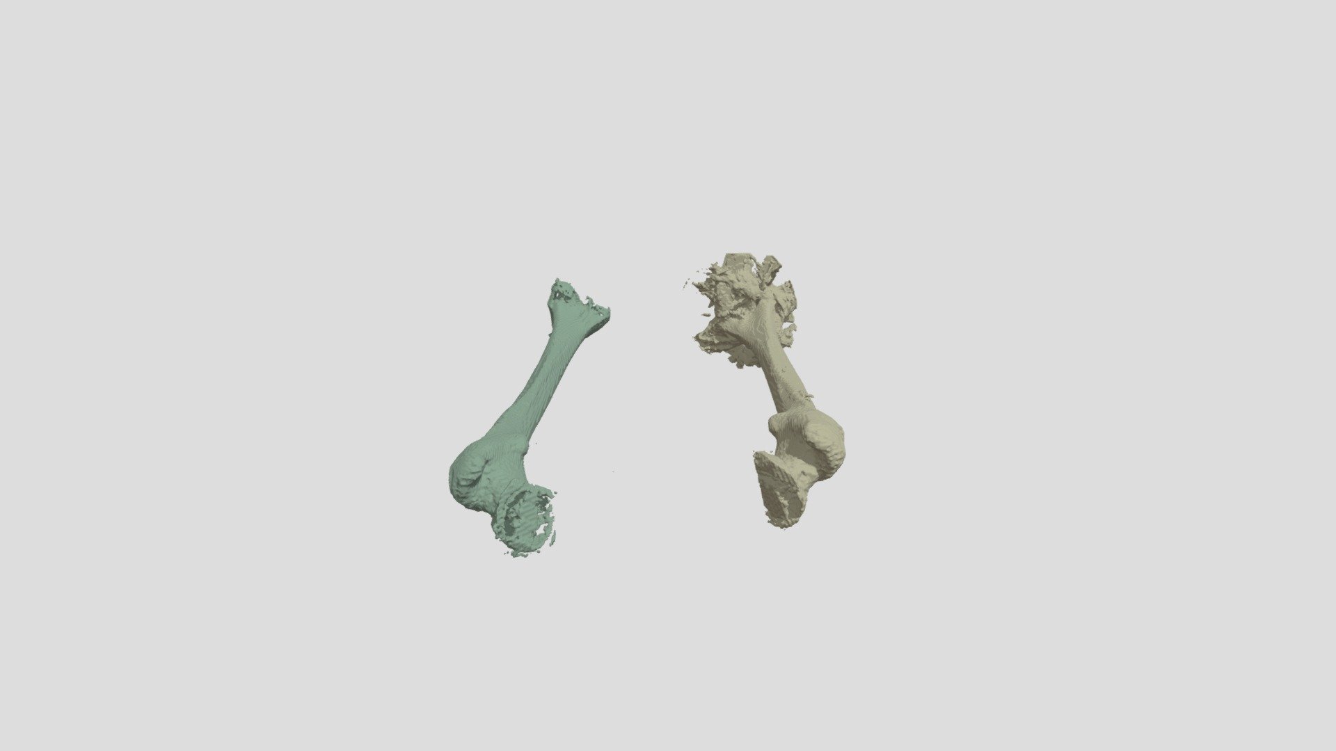 Femur Segments - Download Free 3D model by laurendvorchak [3953b04 ...
