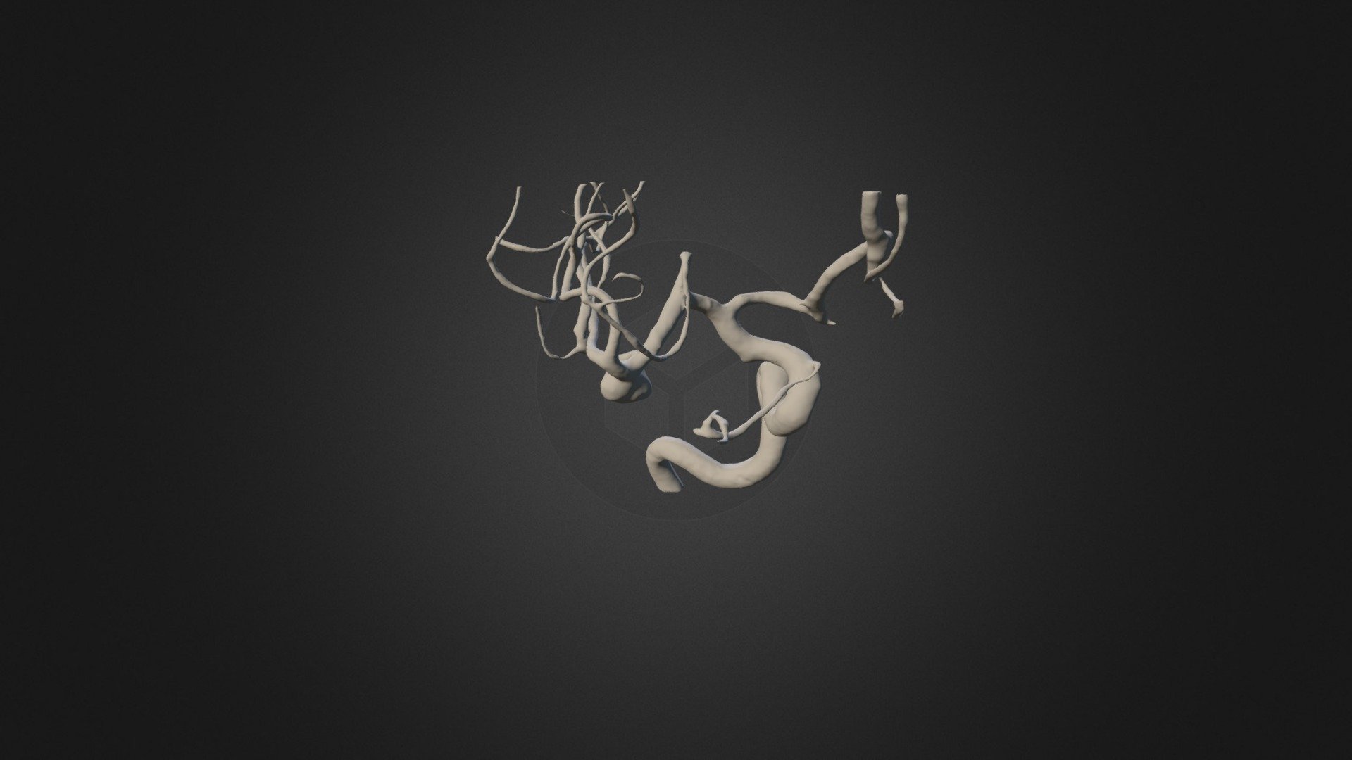 Right ICA (MCA Aneurysm And Fenestrated ACOM) - 3D model by 3D Medical ...