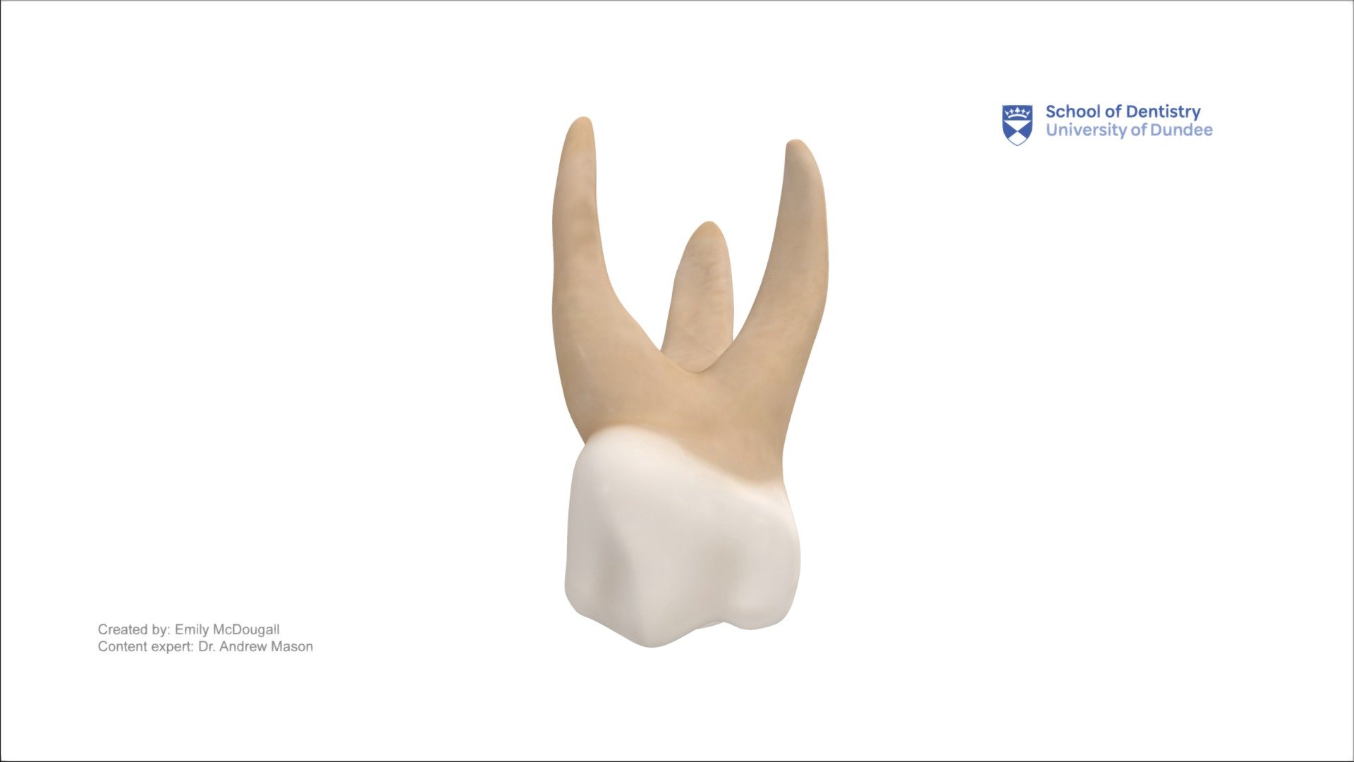 Primary upper left first molar (FDI 64) - Download Free 3D model by ...