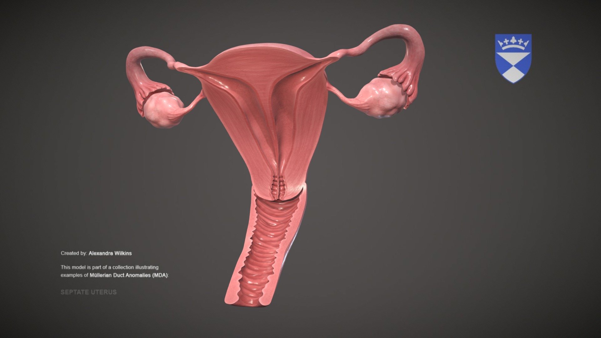 Septate Uterus Anatomy - Cross Section - 3D model by University of ...