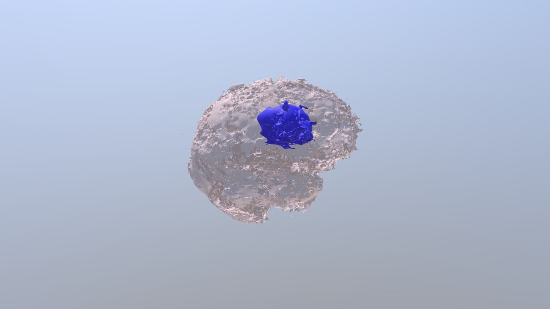 MRI Brain and Tumor - 3D model by ryamegan [3a83c95] - Sketchfab