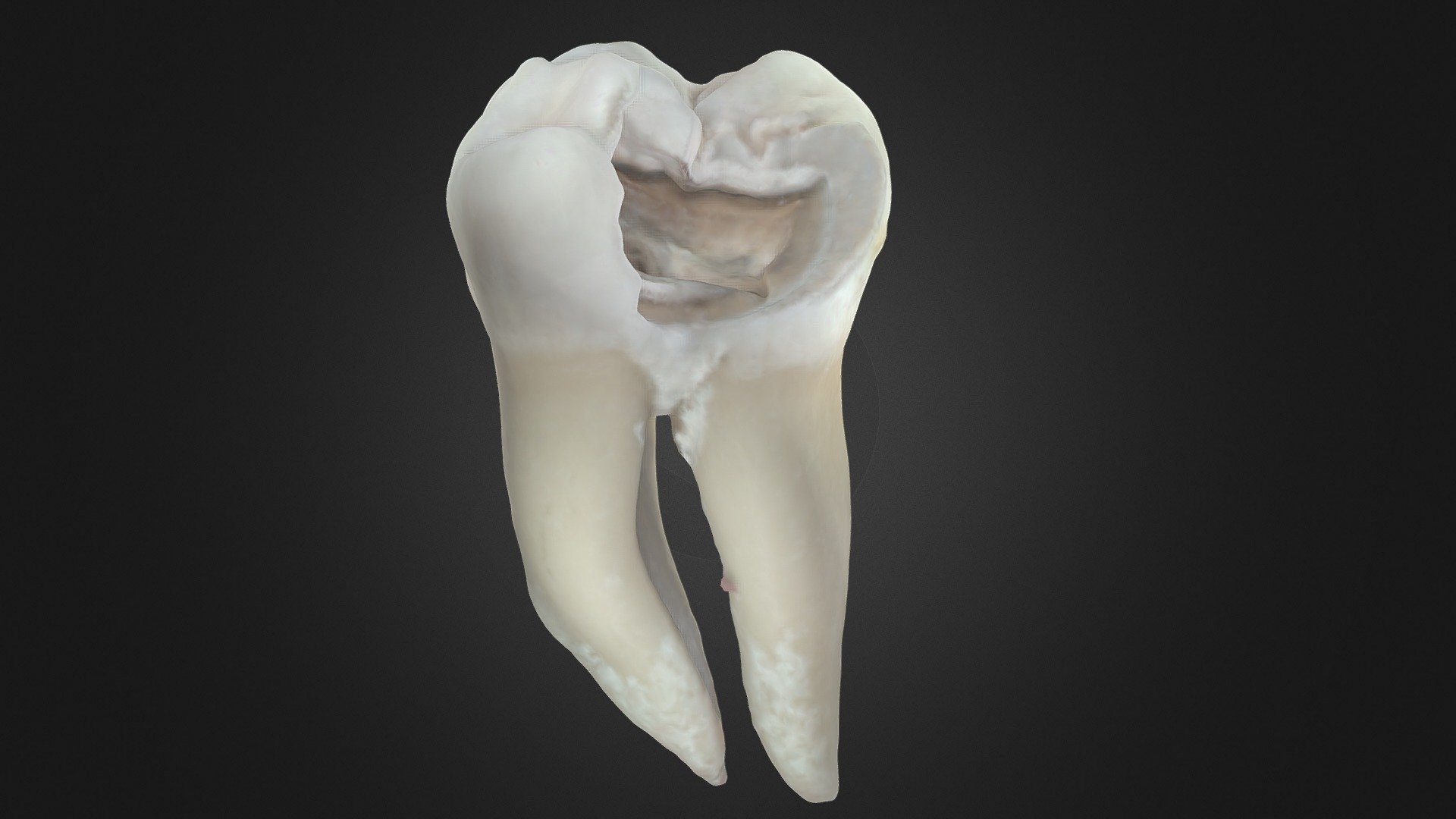 Dente 36 - Lower Left First Molar (ID 36c) - Download Free 3D model by ...