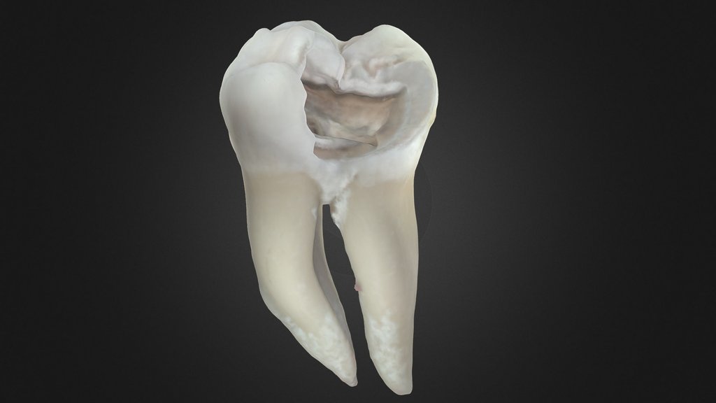 Primeiro Molar Inferior - Lower First Molar - A 3D model collection by ...