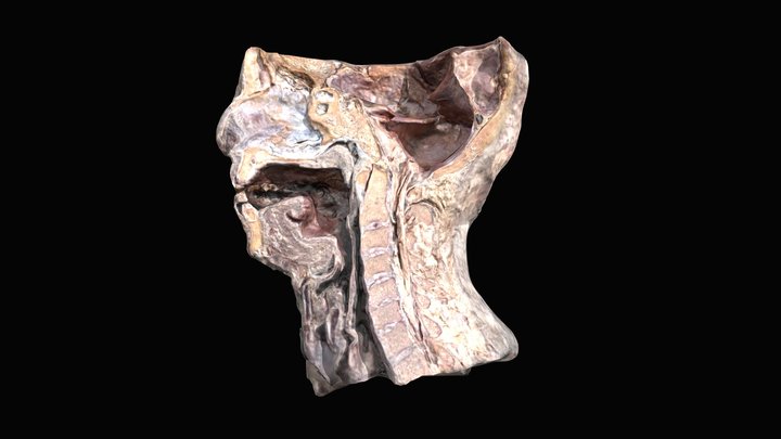 Cadaver 3D models - Sketchfab