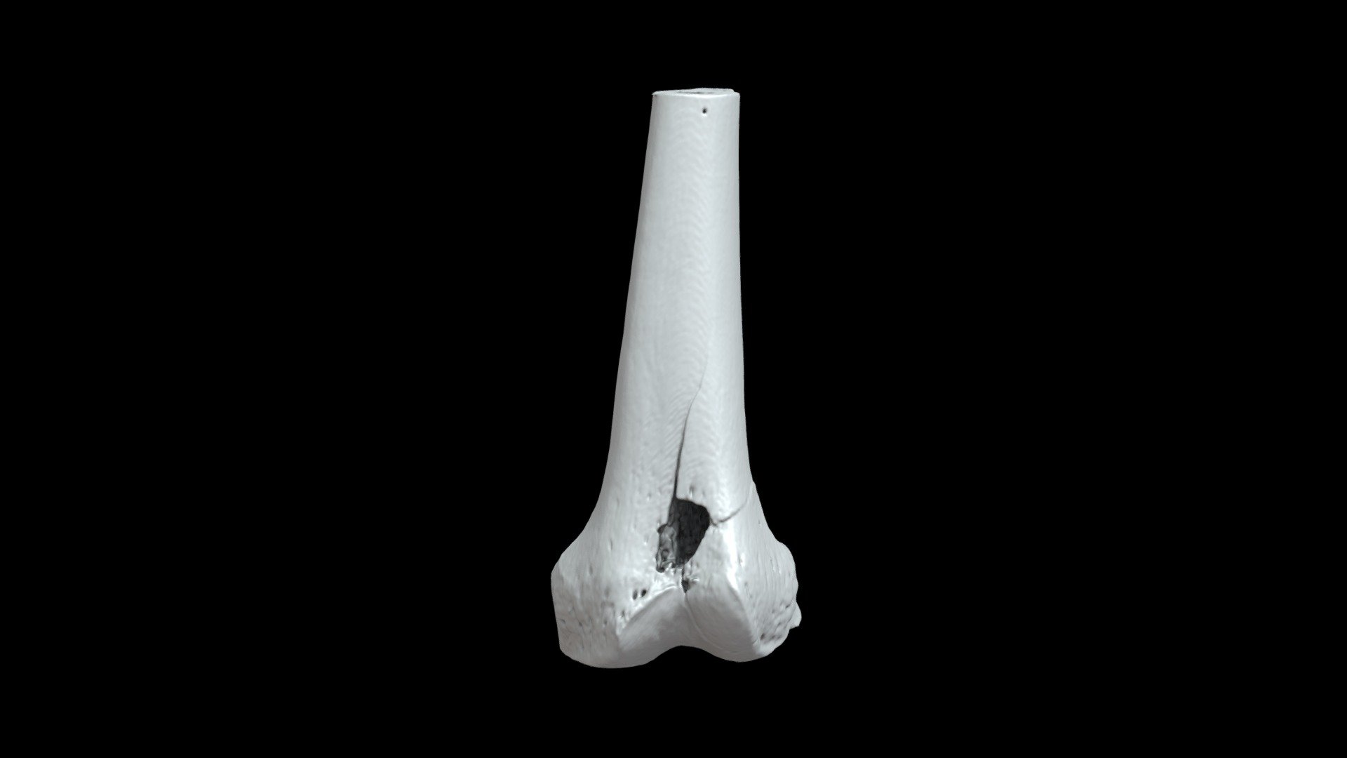 Left Femur with Gunshot Wound (VCU_3D_5402) - 3D model by Virtual ...