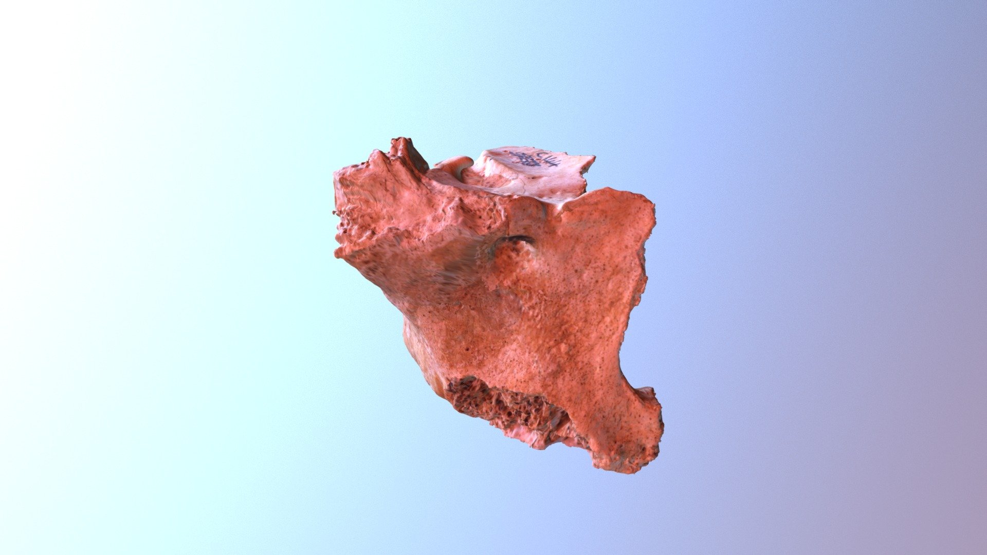 Sinusitis - Right Maxilla - 3D model by BU Forensic Anthropology - Neil ...