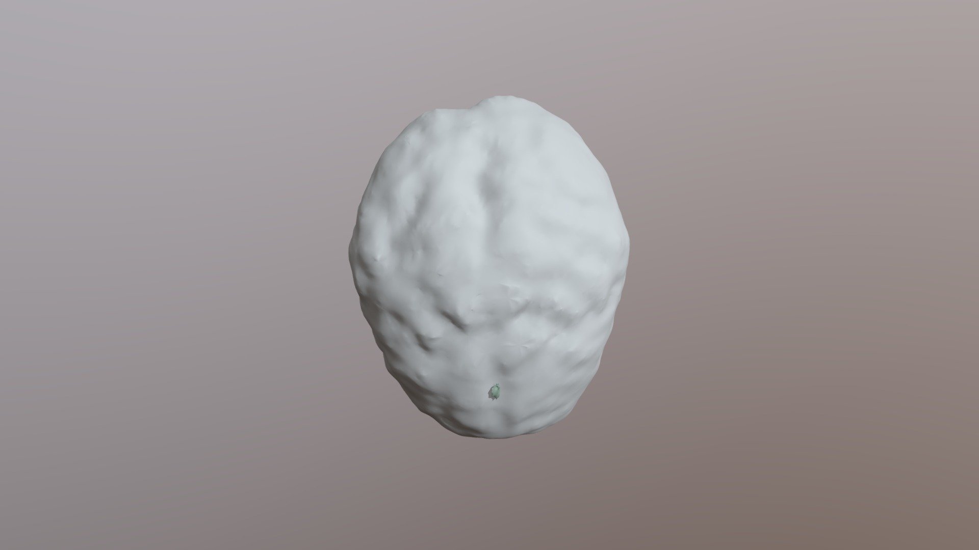 Tumor Segmentations Download Free 3d Model By Allisonmcguire [3b50a34