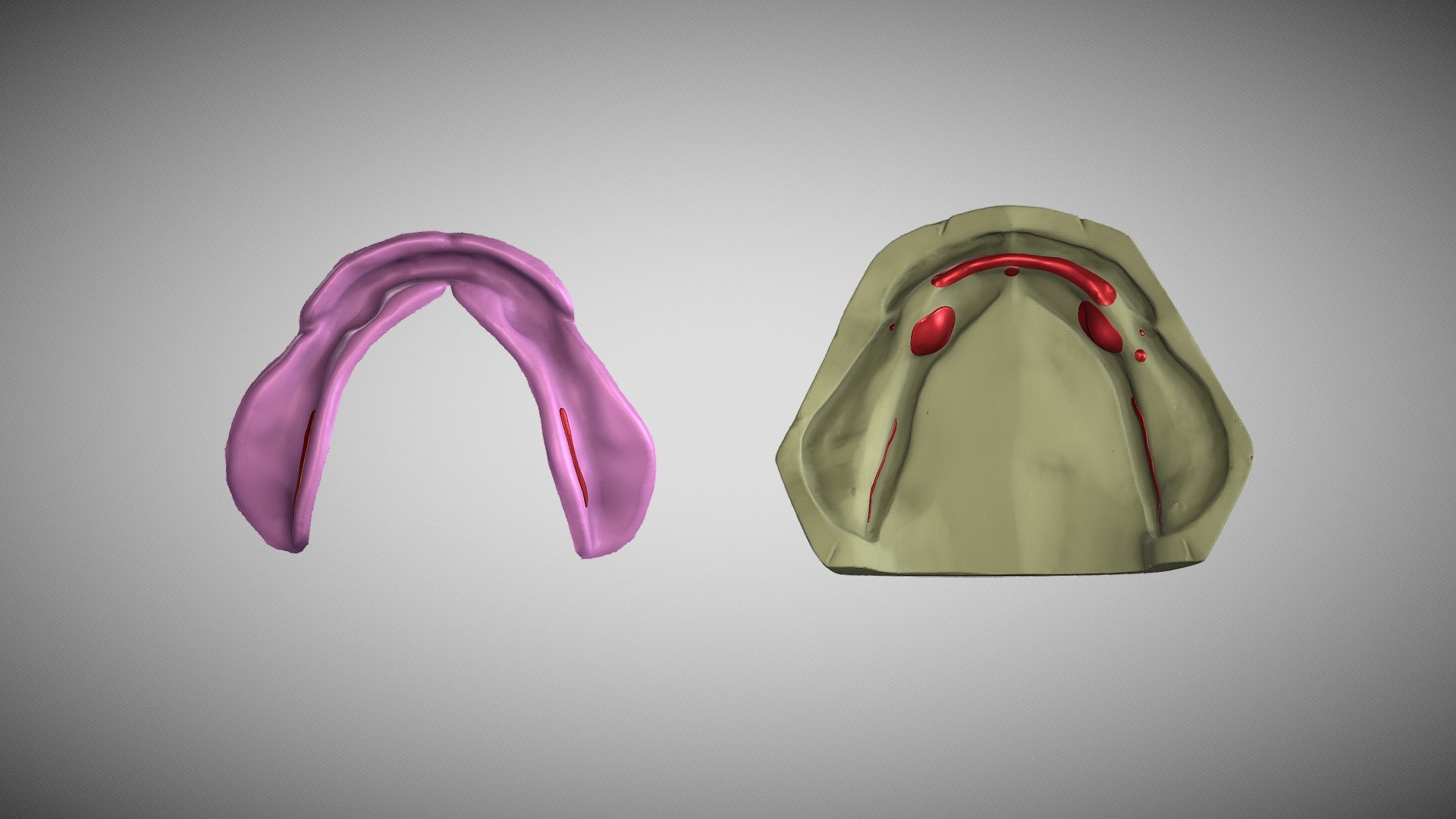 Mandibular Relief Areas - 3D model by Muhammad Nabeel ...