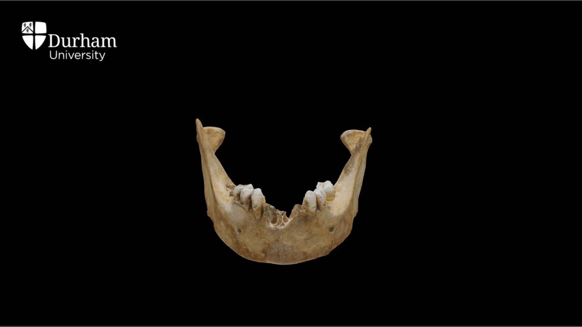 Female Mandible with annotations - 3D model by Durham Archaeology ...