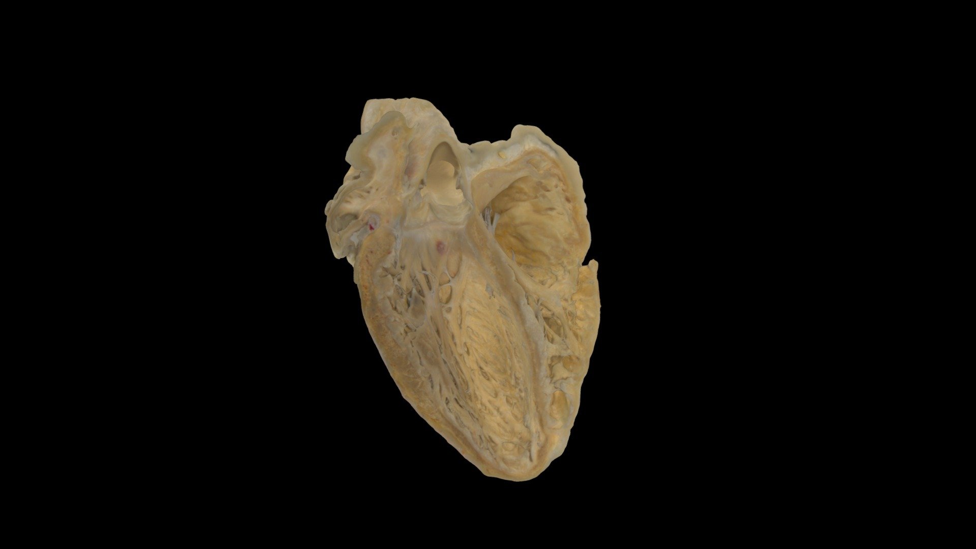 Plastinated Human Heart Anterior #0111 - Download Free 3D model by ...