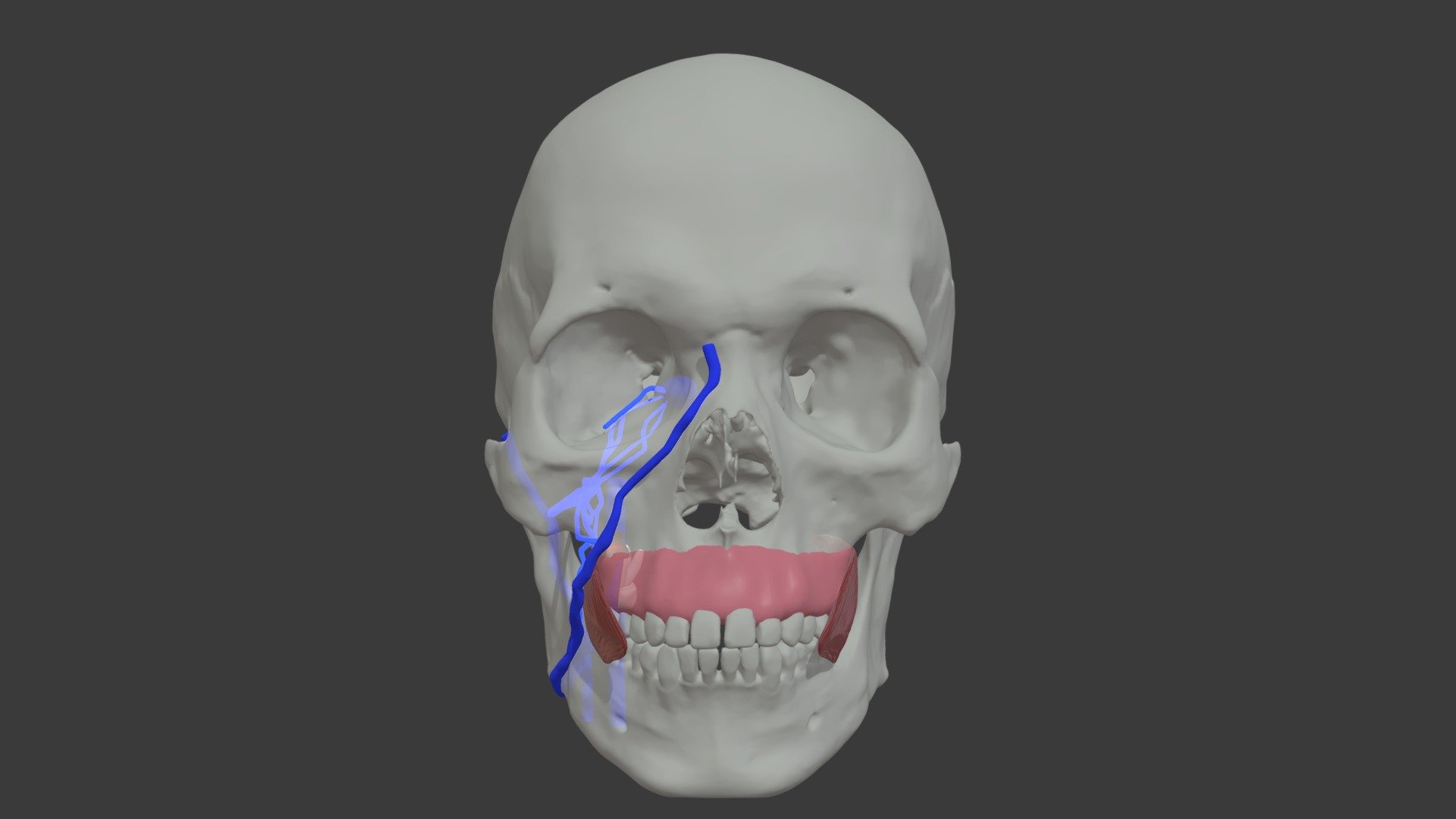 Stage 7 Long Root Maxillary Dental Infection - 3D model by University ...