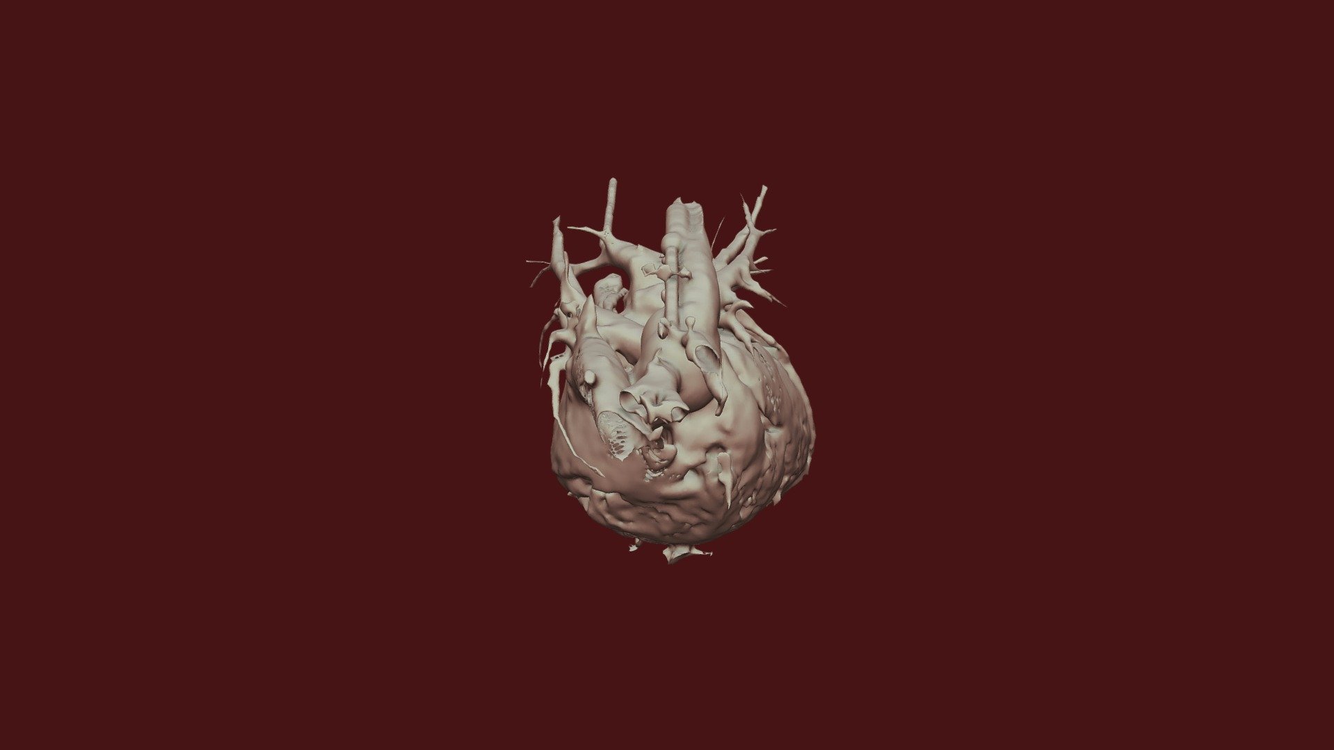 heart_abnormal - Download Free 3D model by shah.rushabh199 [3c1f206 ...