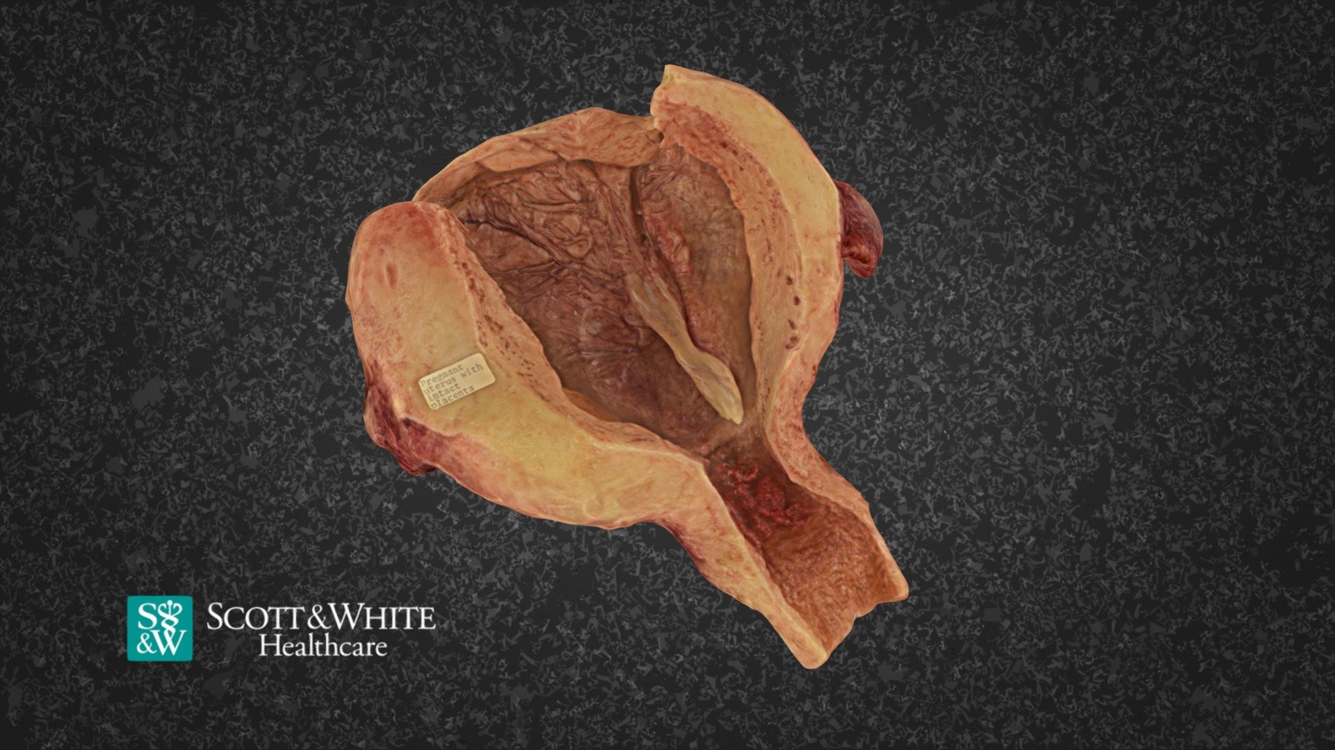 Pregnant Uterus with Intact Placenta 301243 - 3D model by Scott & White ...