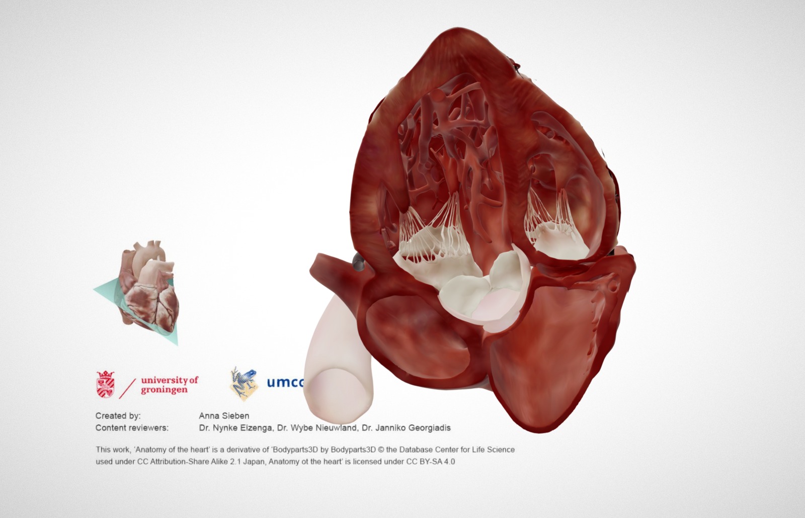 Cardiac Anatomy: Other Half Apical 5 Chamber - Download Free 3D model ...