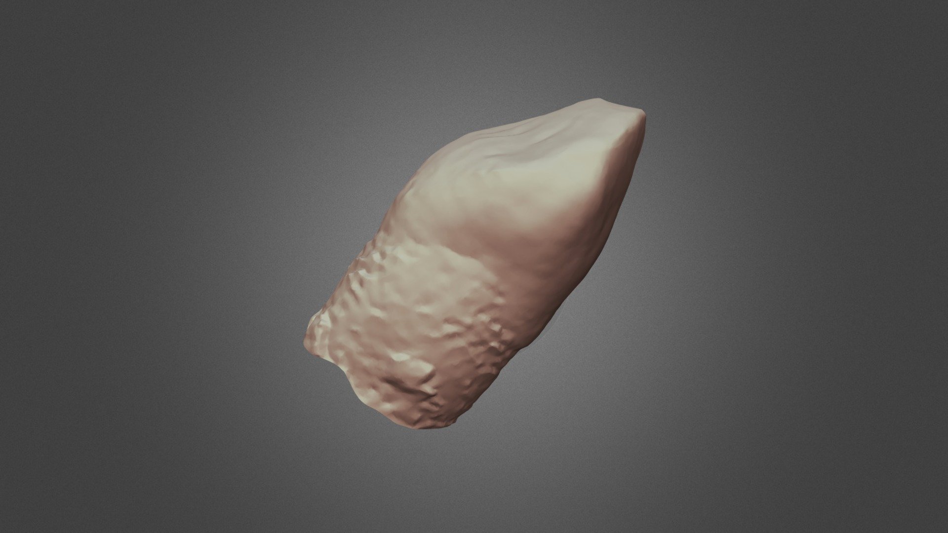 groups 9 and 11, scanner 6, tooth#27 - 3D model by UMdental [3d0a283 ...