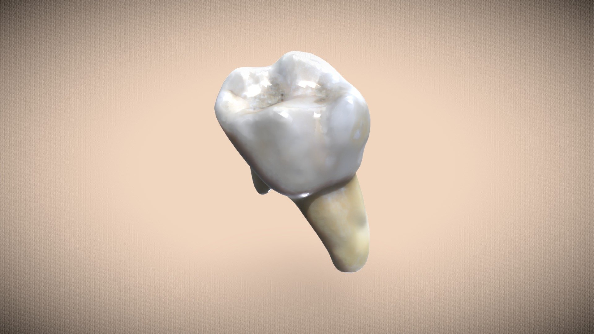 Tooth - 3D model by Carmen (@carmenvitu) [3d1aaed] - Sketchfab