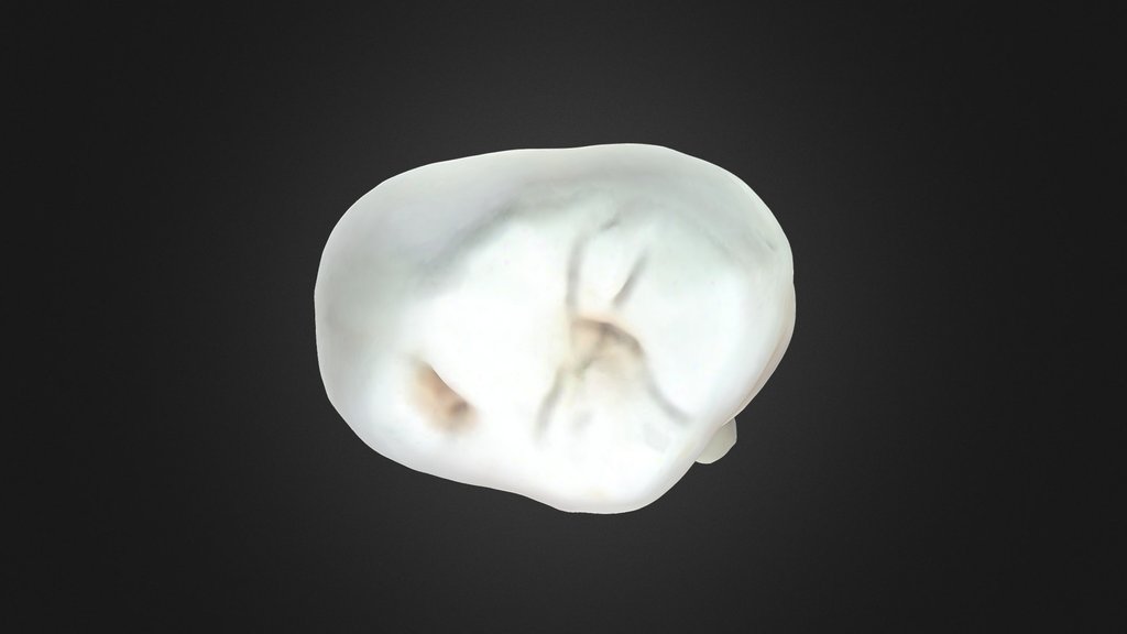 Terceiro Molar Superior - Upper Third Molar - A 3D model collection by ...